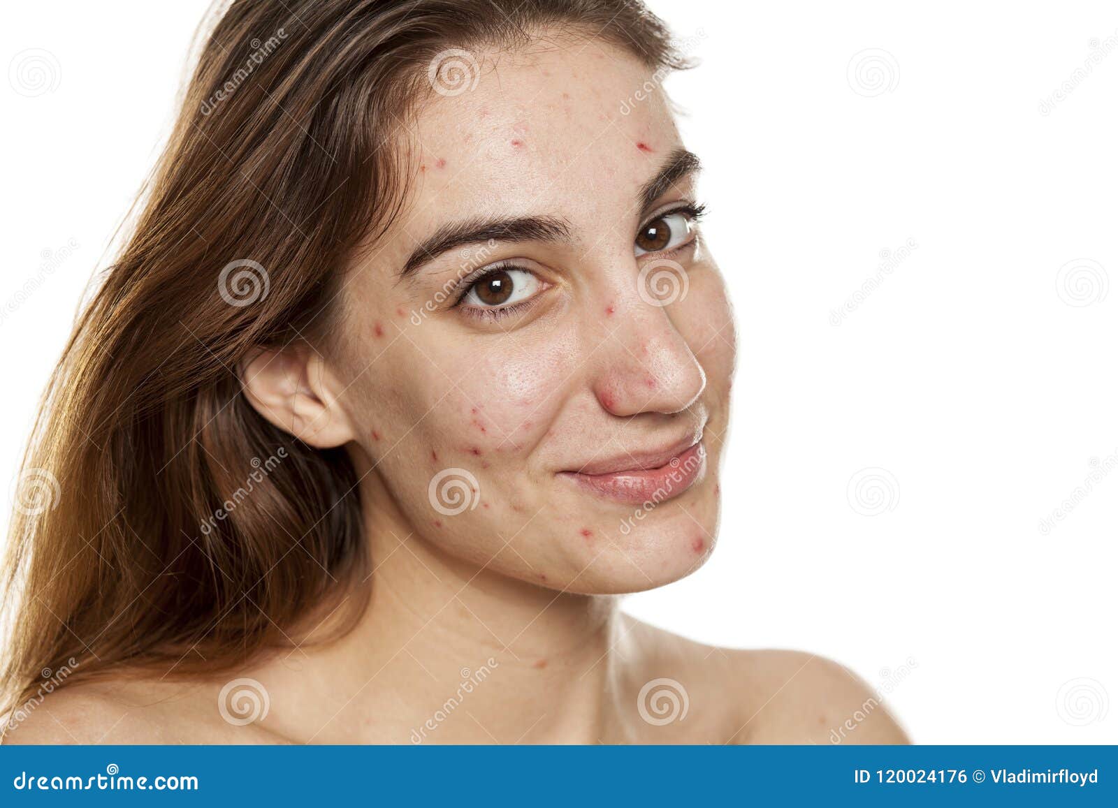 Problematic skin stock photo. Image of problem, beauty - 120024176