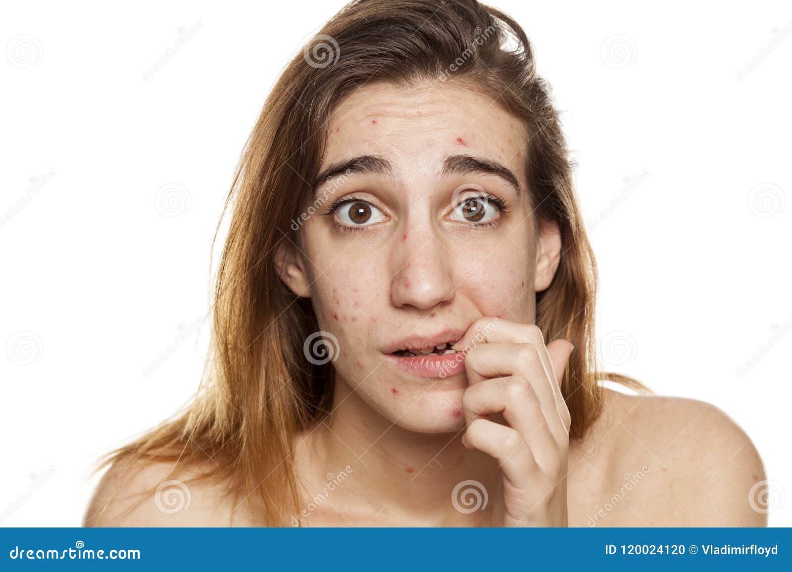 Problematic skin stock photo. Image of irritation, concerned - 120024120