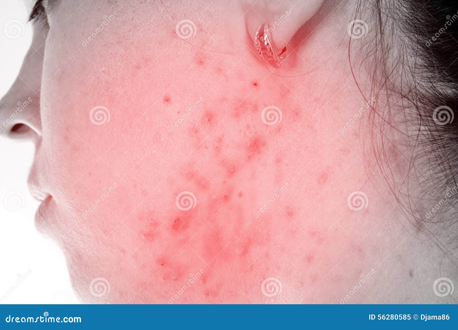 Problems with skin stock image. Image of background, medicine - 56280585