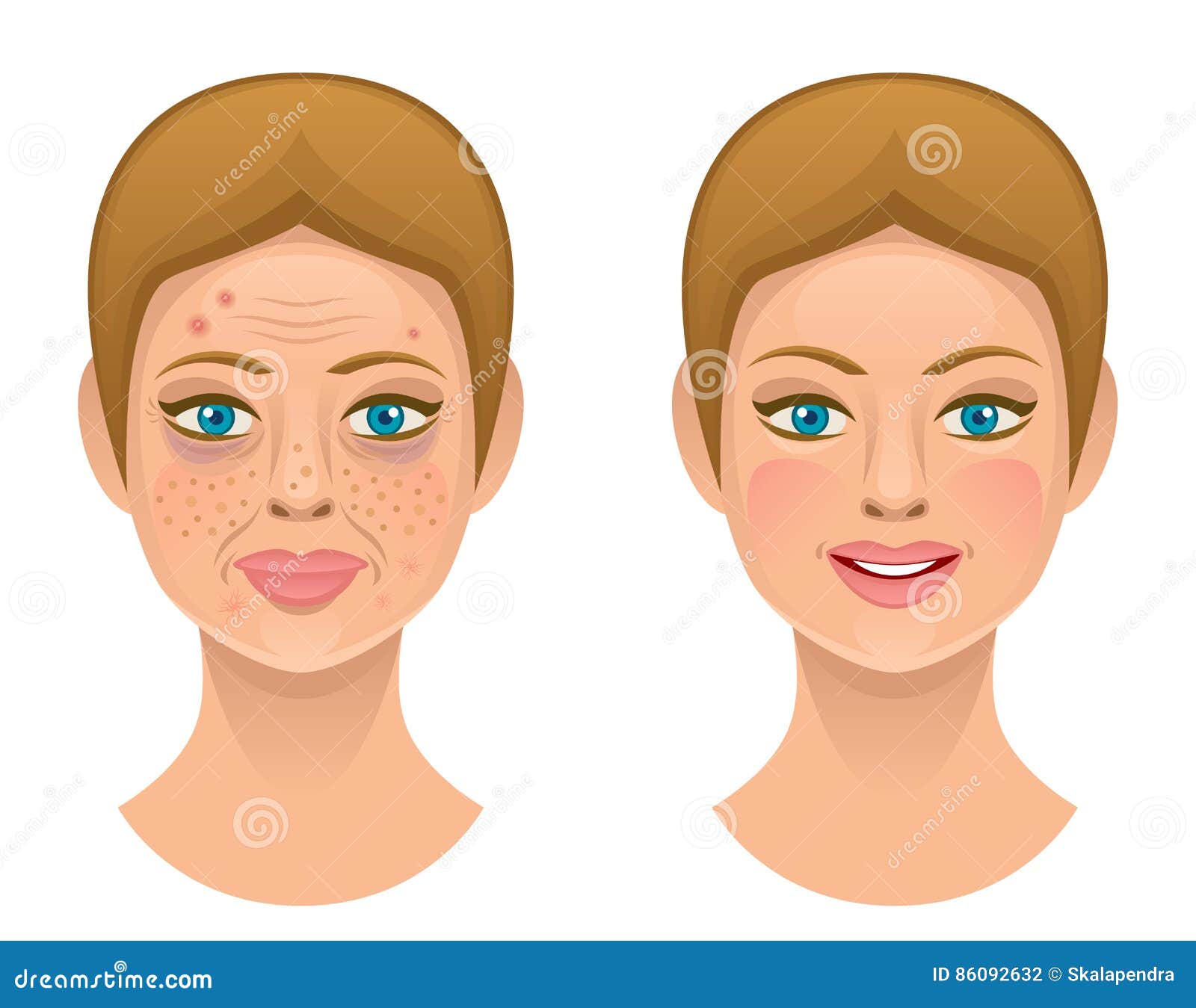 Problems Skin Stock Illustrations – 1,493 Problems Skin Stock ...