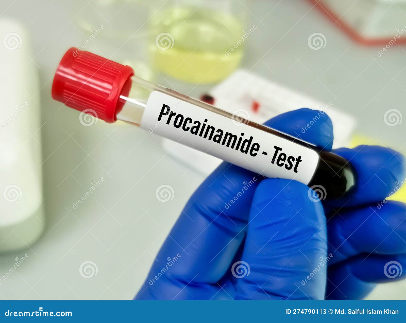 Procainamide Blood Test, To Set Therapeutic Range for Patient. Stock ...