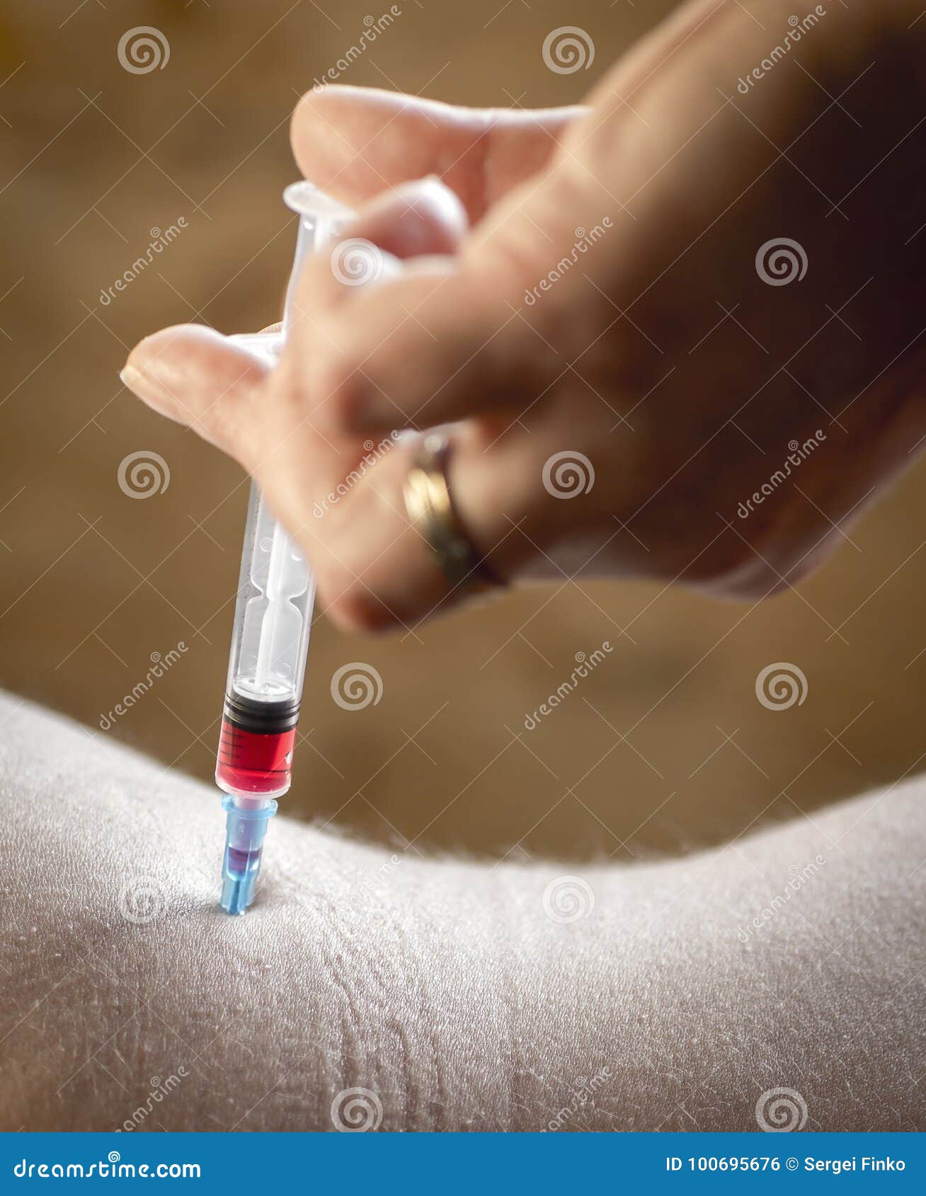 Procedimiento Para Inyectar Una Medicina Foto de archivo - Imagen de ...