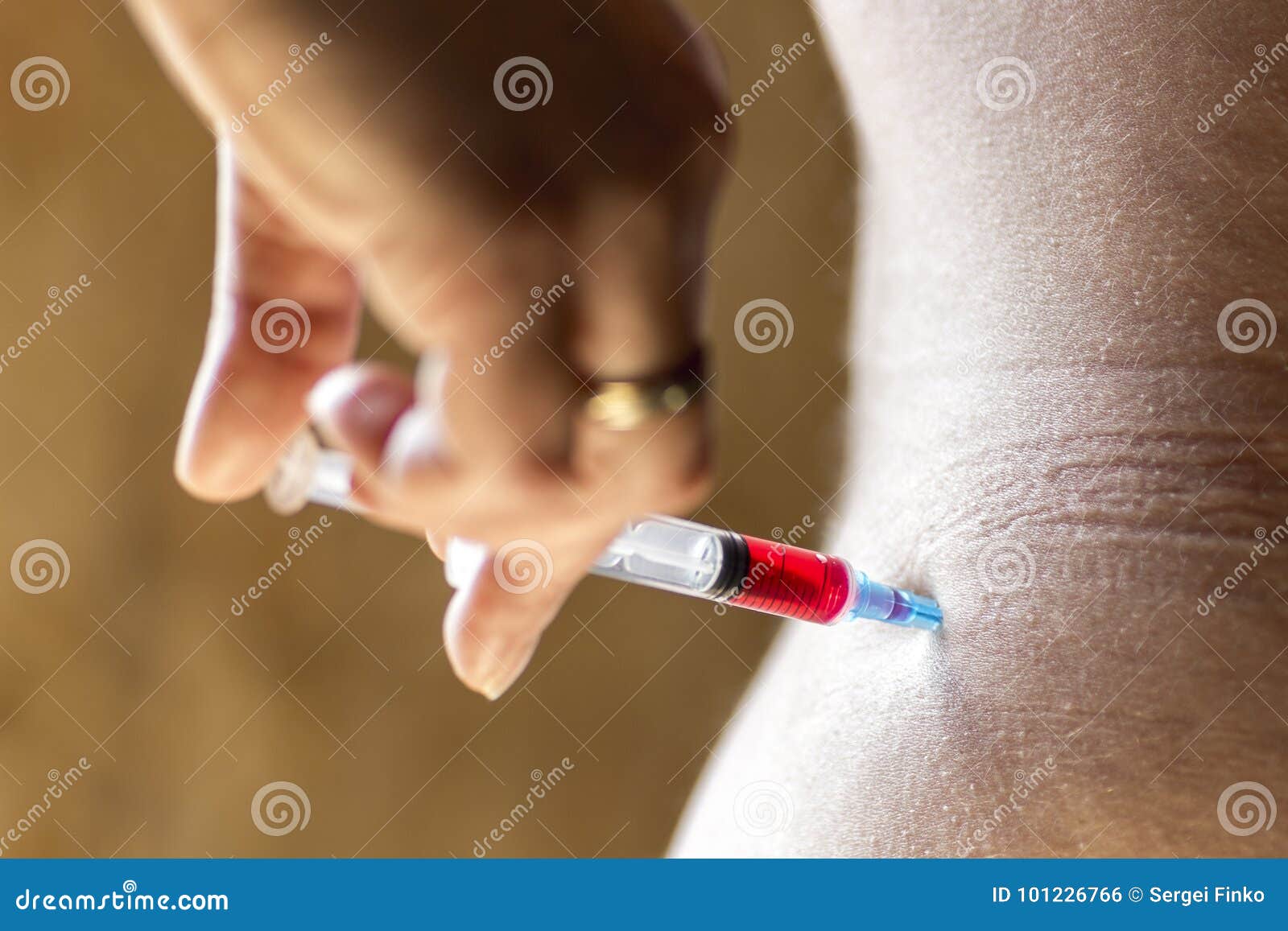 Procedimiento Para Inyectar Una Medicina Foto de archivo - Imagen de ...