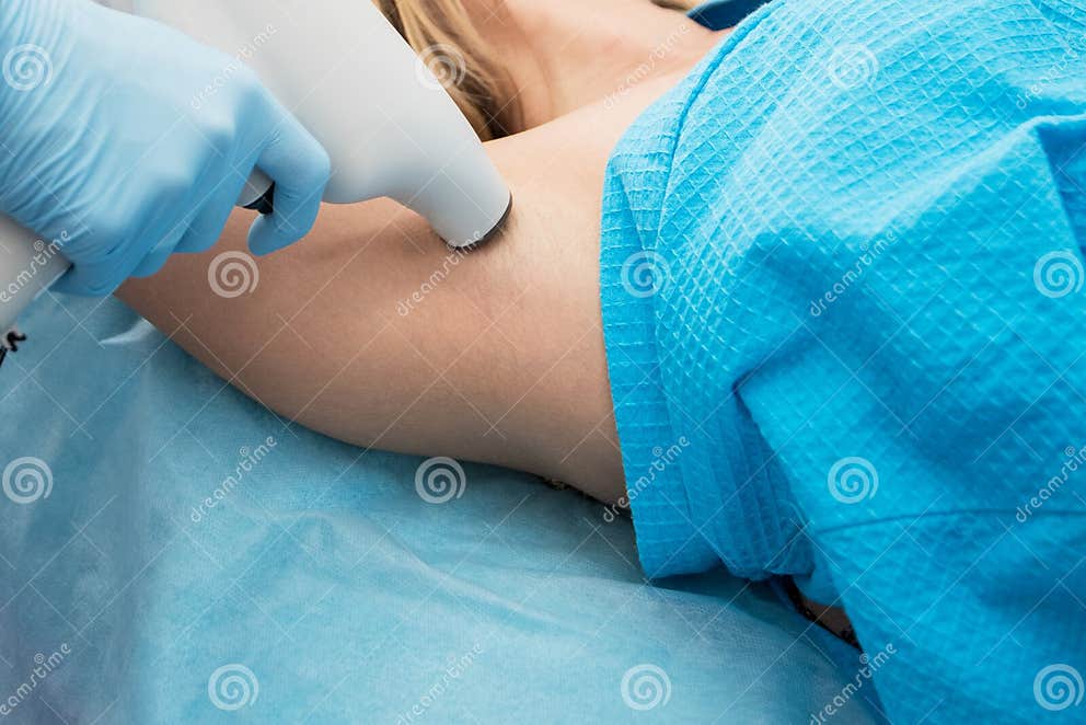 Procedure Against Hyperhidrosis Stock Image - Image of hyperhidrosis ...
