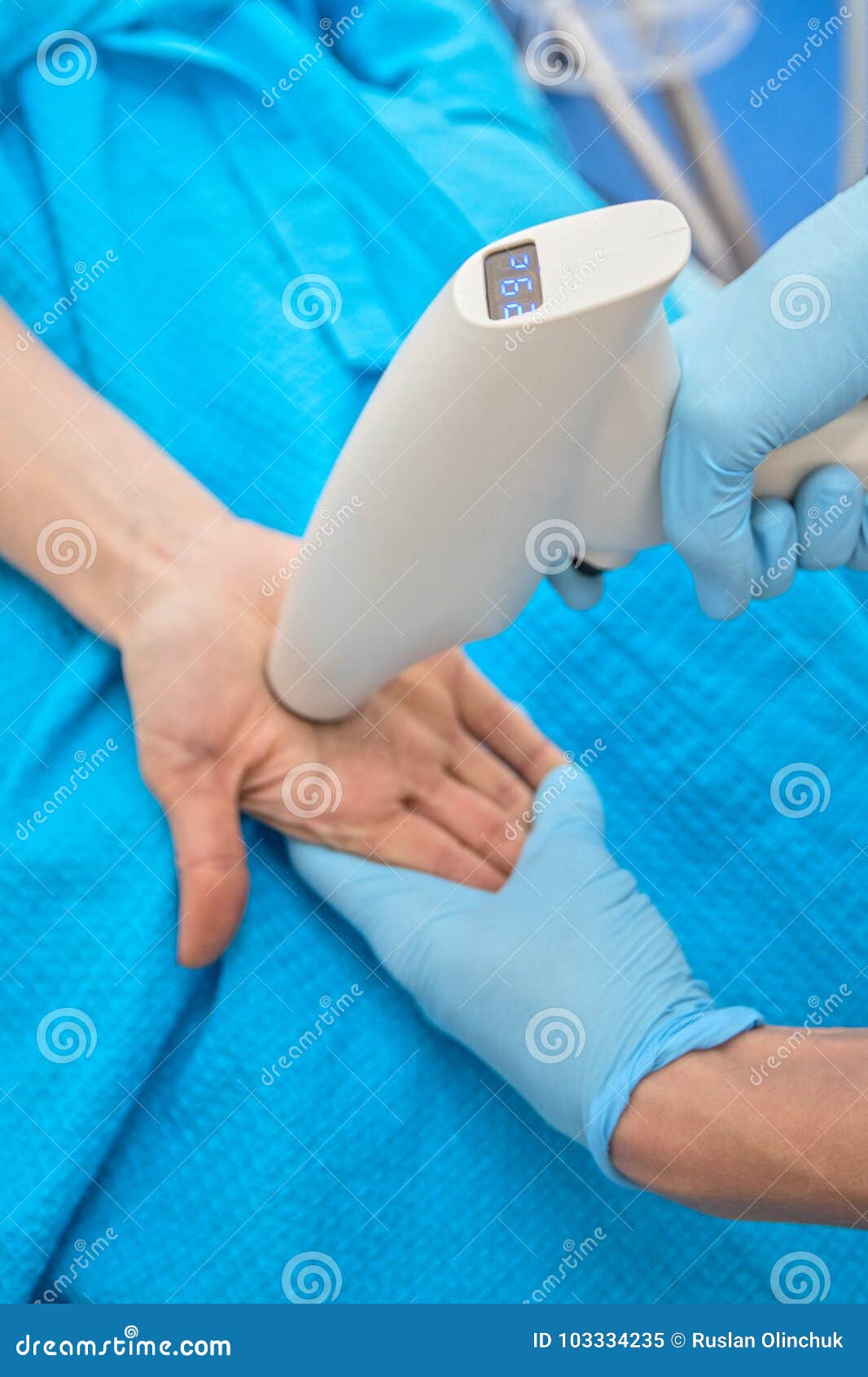 Procedure Against Hyperhidrosis Stock Image - Image of lying, laser ...
