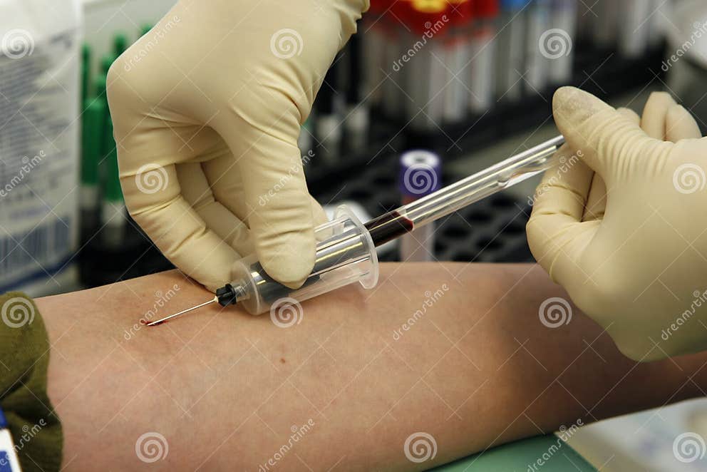 Procedure of a Blood Capture Stock Image - Image of intravenous ...