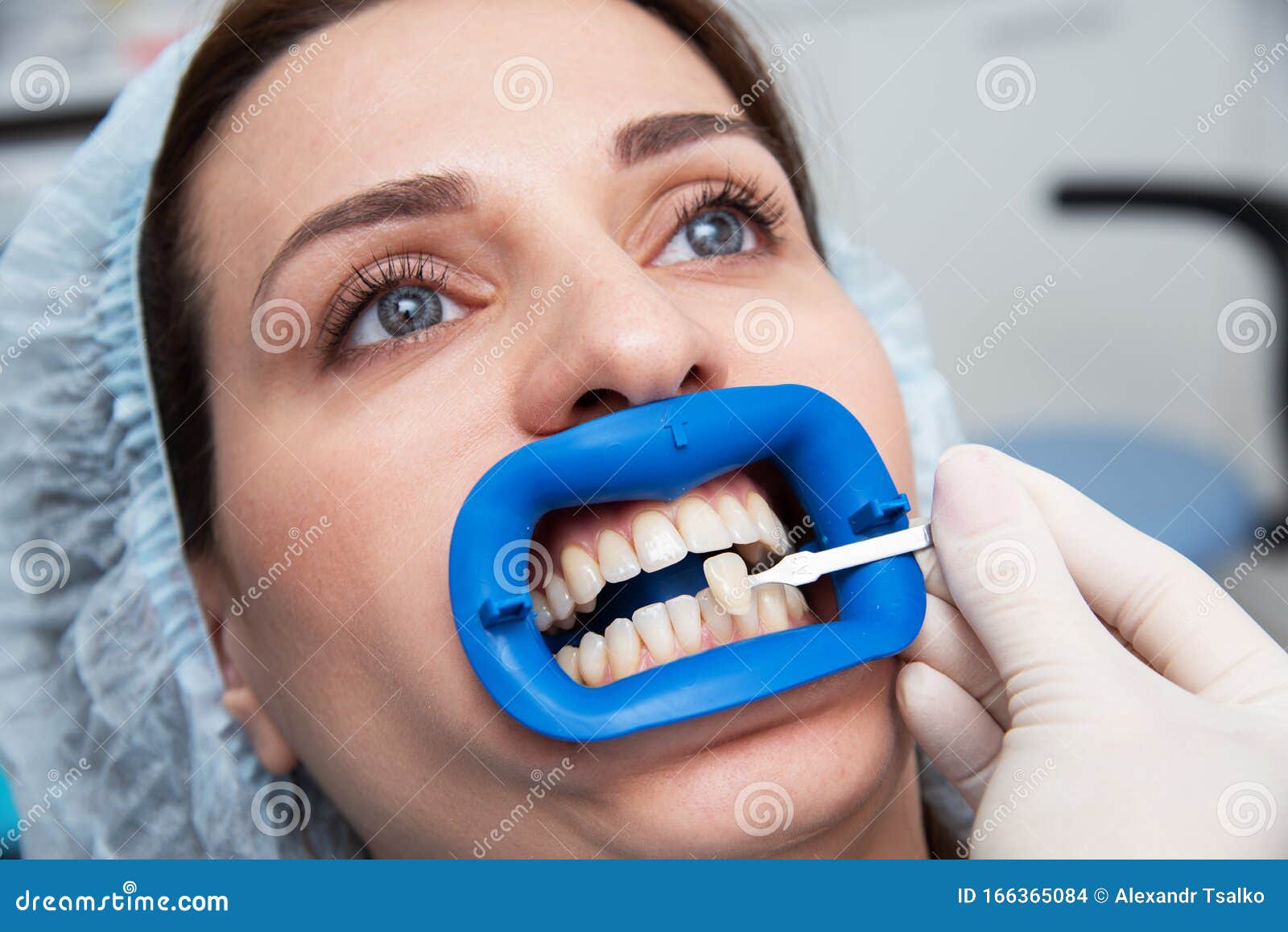 Procedure for Comparing the Color Shades of Teeth Using Tests before ...