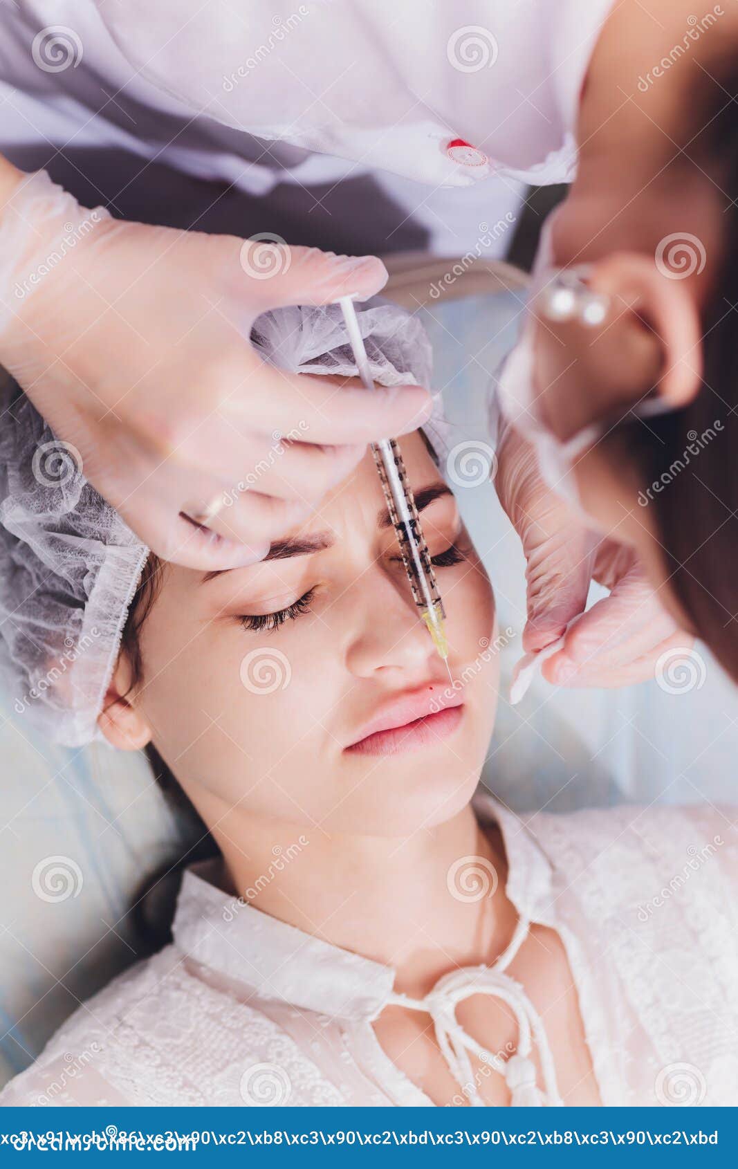 Procedure Of Lips Augmentation With Hyaluronic Acid Injection Stock Image Image Of Correction