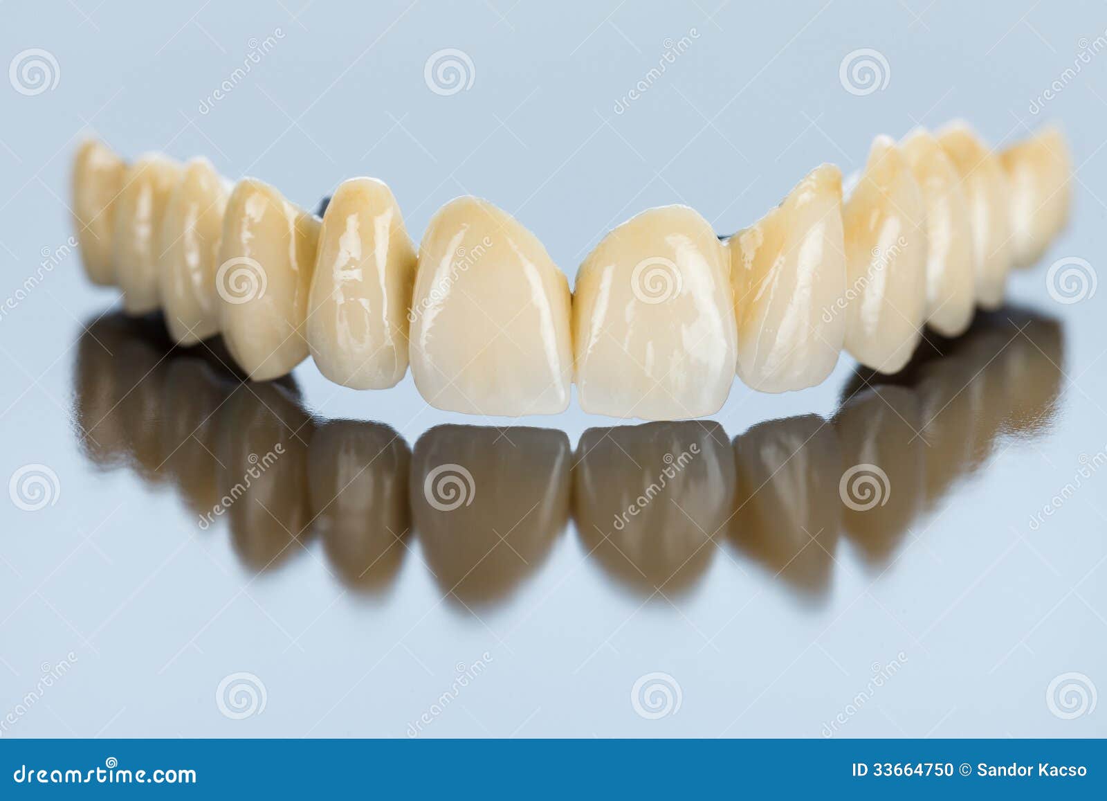 Procelain Teeth on Metallic Basis Stock Photo - Image of dentist ...