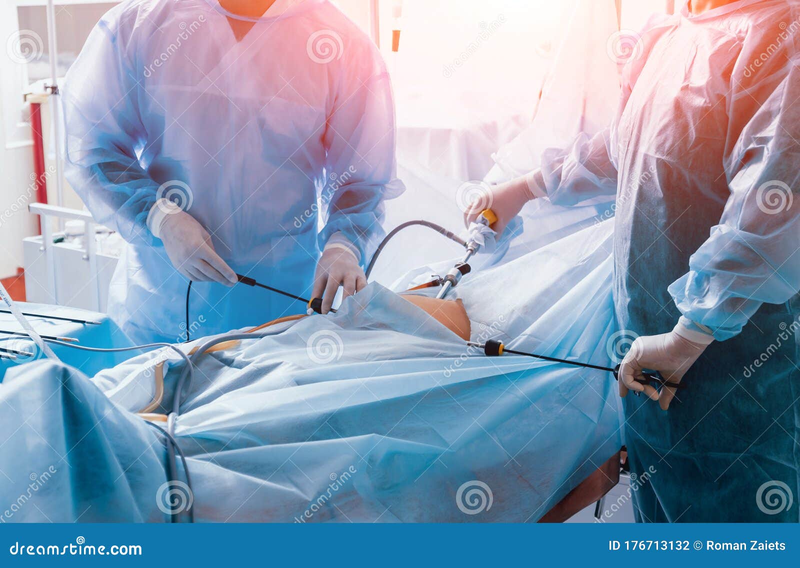 Proces Van Gynaecologische Chirurgie Met Behulp Van Laparoscopische