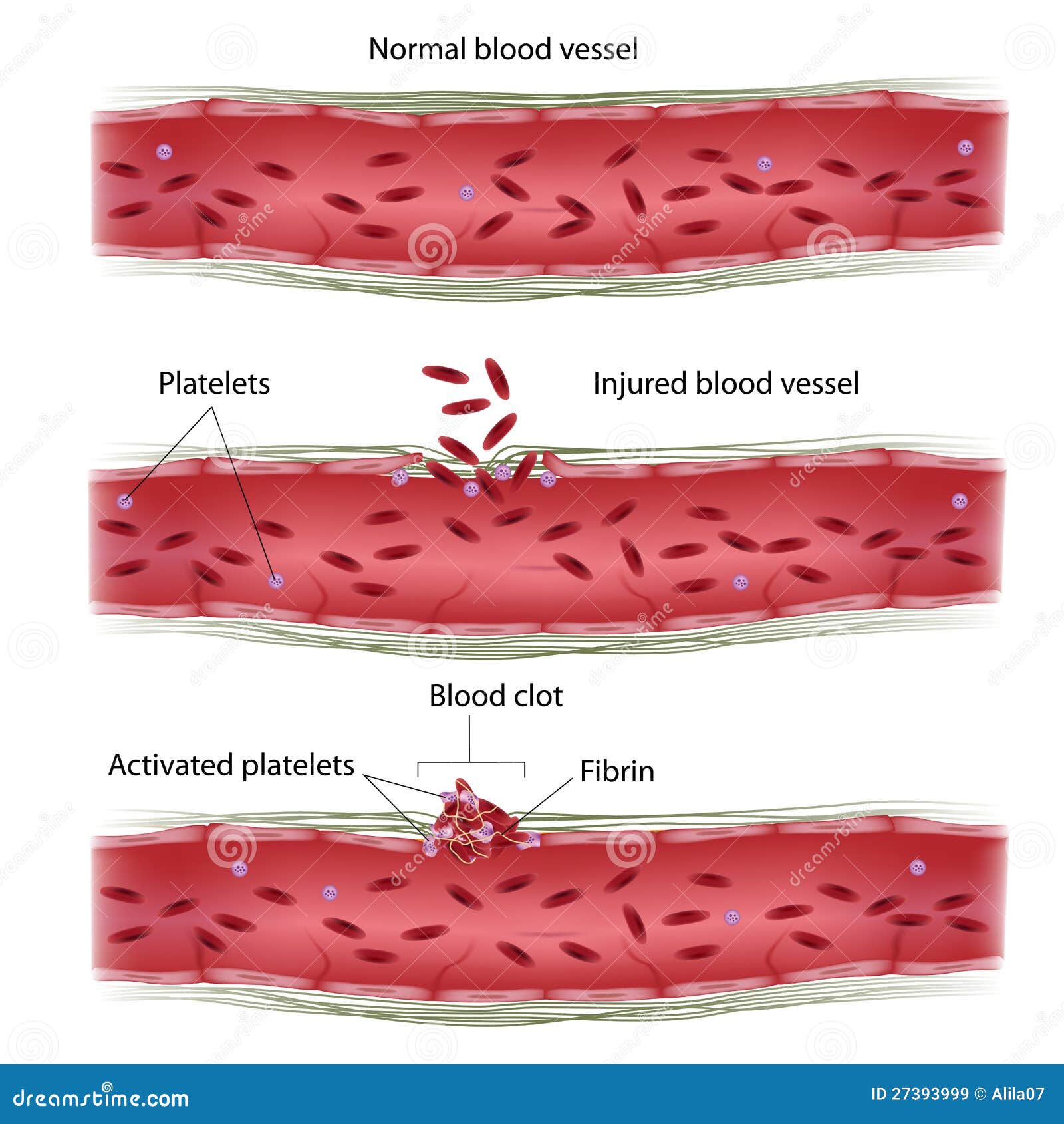 Proceso De La Coagulación De Sangre Ilustración del Vector ...