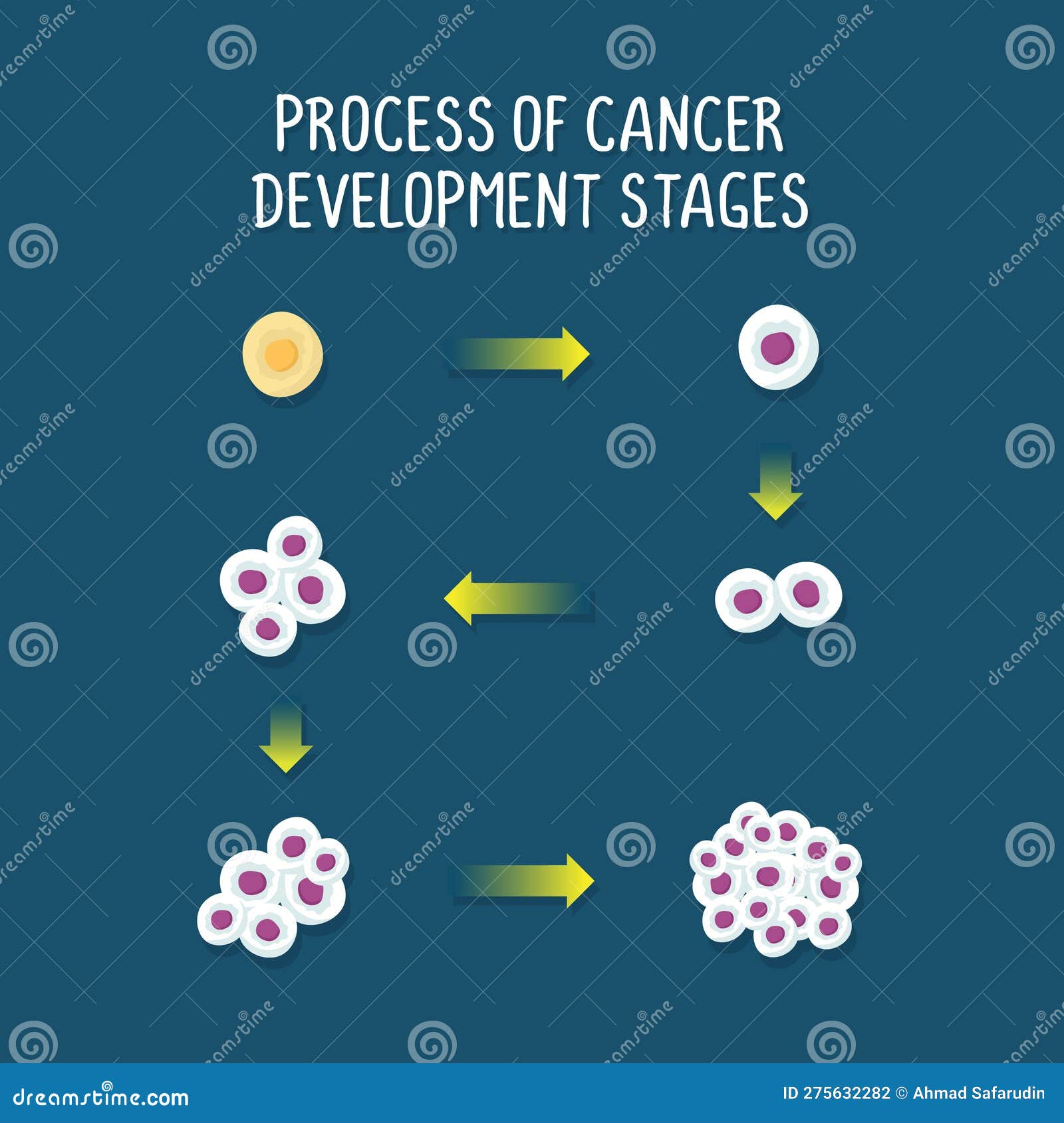 Process of Cancer Development Stages Illustration Isolated on Dark ...