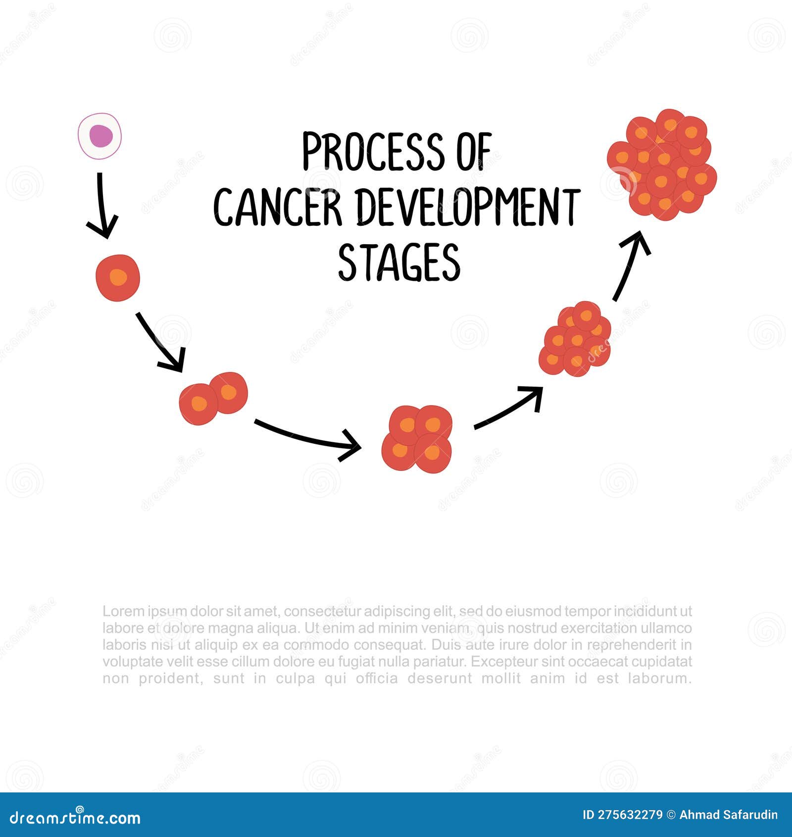 Process of Cancer Development Stages Illustration Isolated on White ...