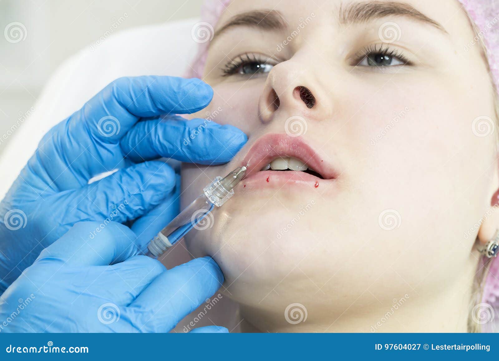 The Process of Cosmetic Surgery of Injection Stock Image - Image of ...