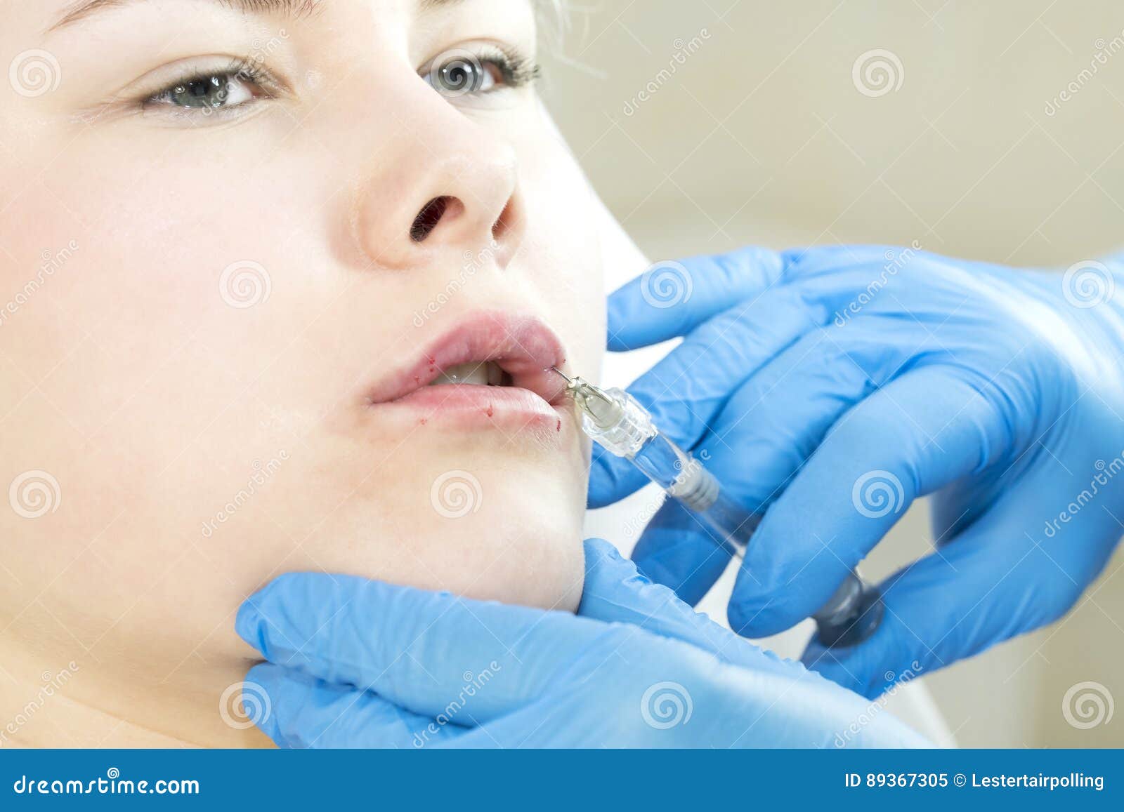 Process of Cosmetic Surgery of Water Injection Stock Image - Image of ...