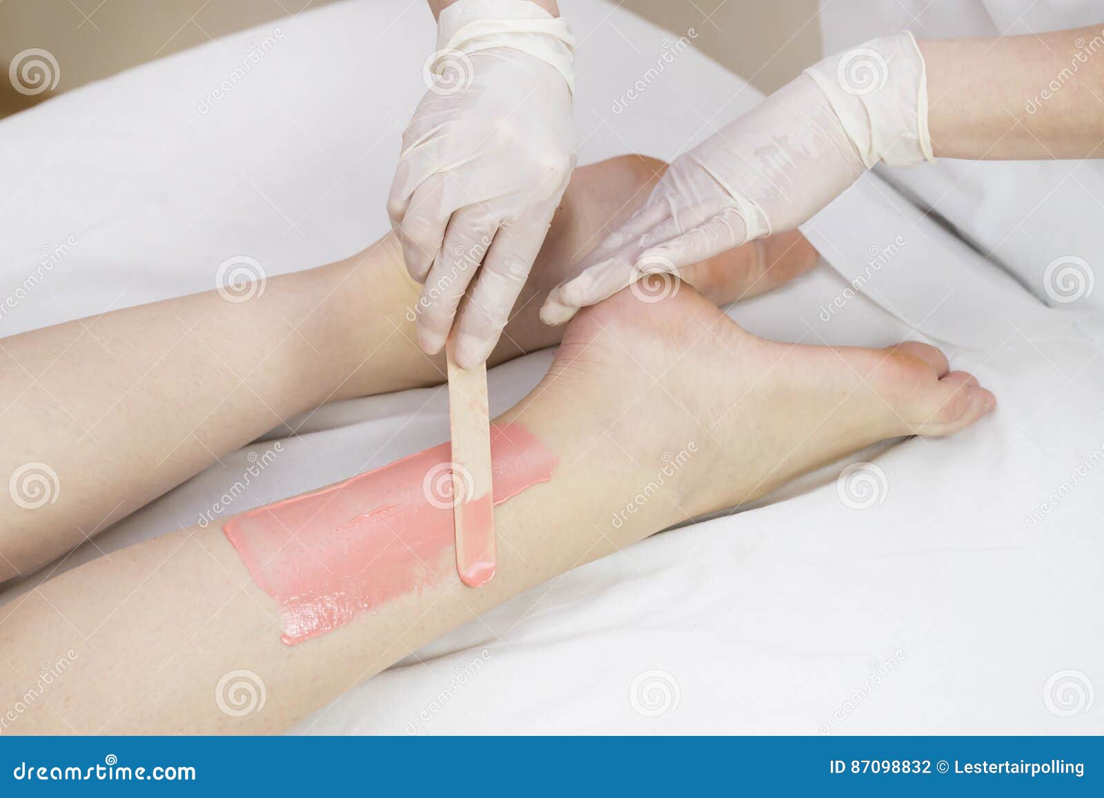 Process Depilation Female Legs and Hands Stock Photo - Image of peel ...