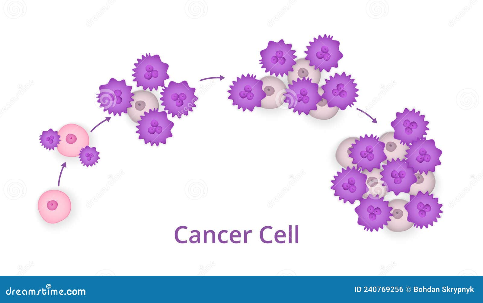 Process of Development of Cancer Cells Stock Vector - Illustration of ...