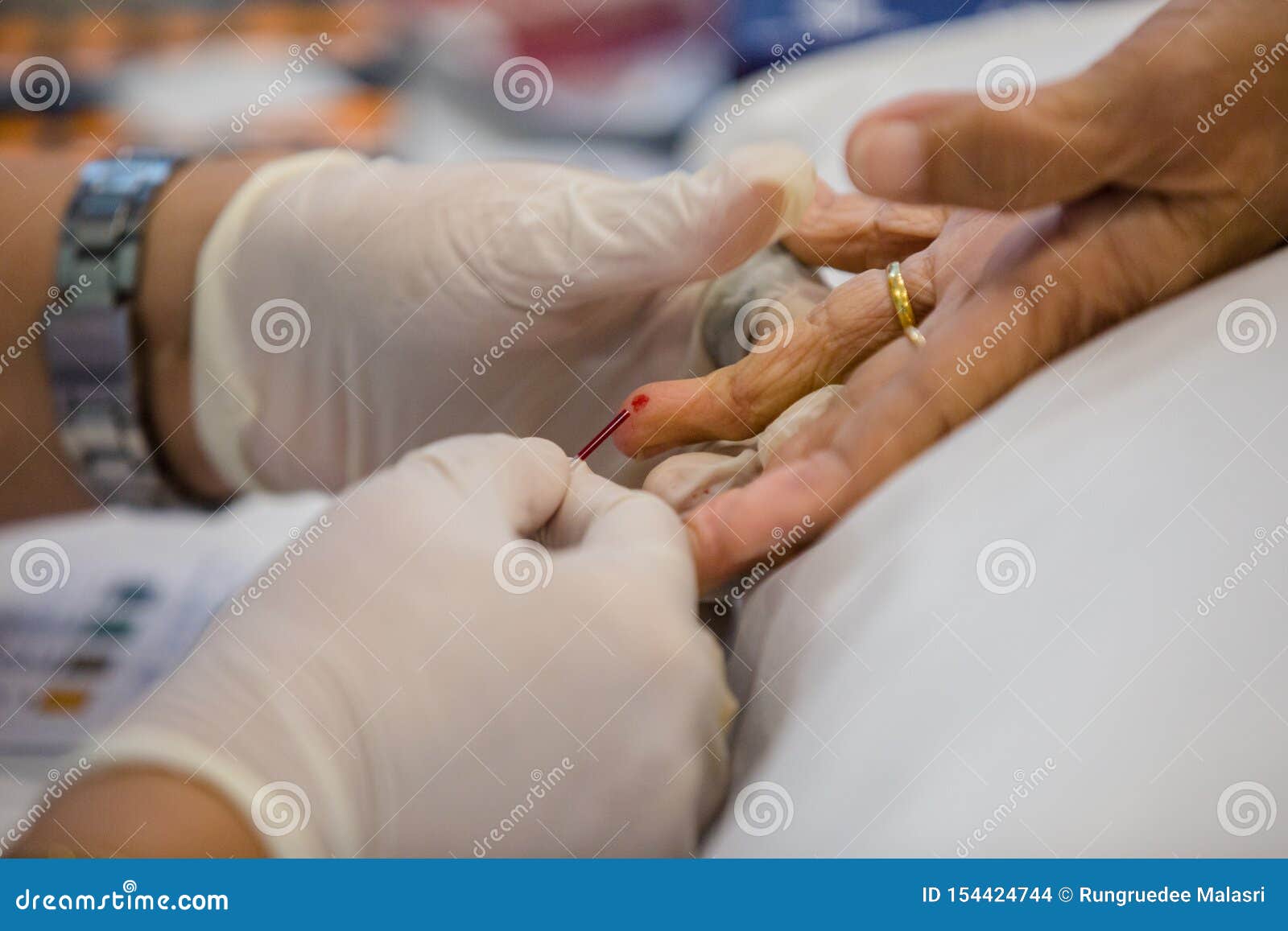 Process of Drawing Blood from a Finger Stock Photo - Image of diabetes ...