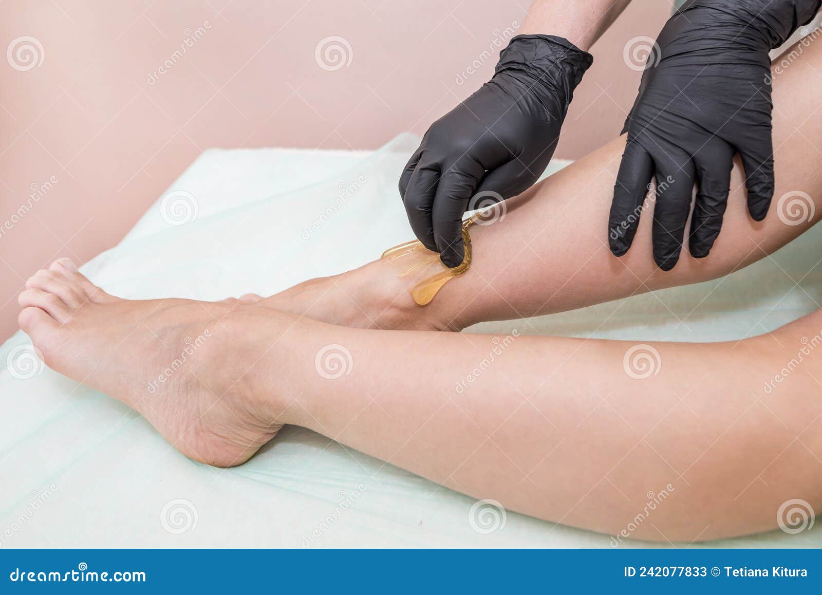 The Process of Epilation of the Legs by the Method of Shugaring, Using ...