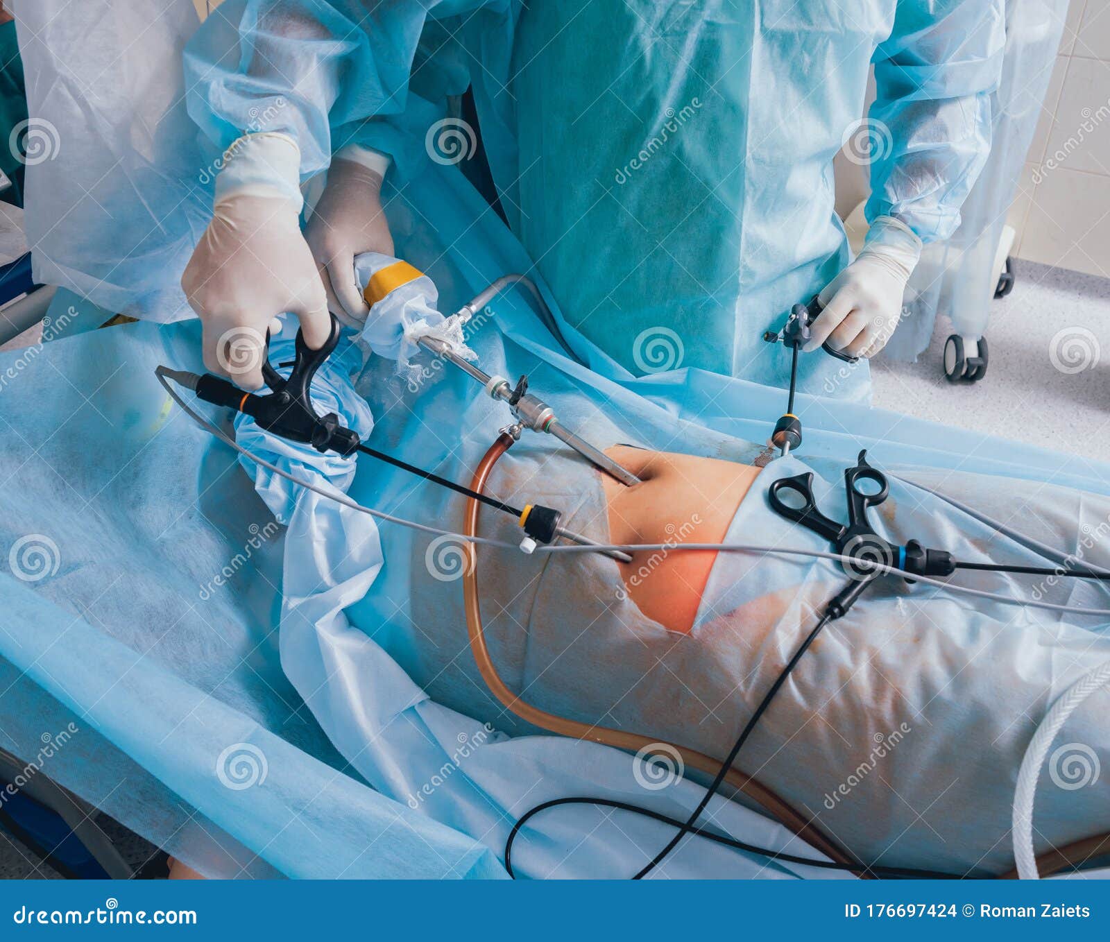 Process of Gynecological Surgery Operation Using Laparoscopic Equipment ...