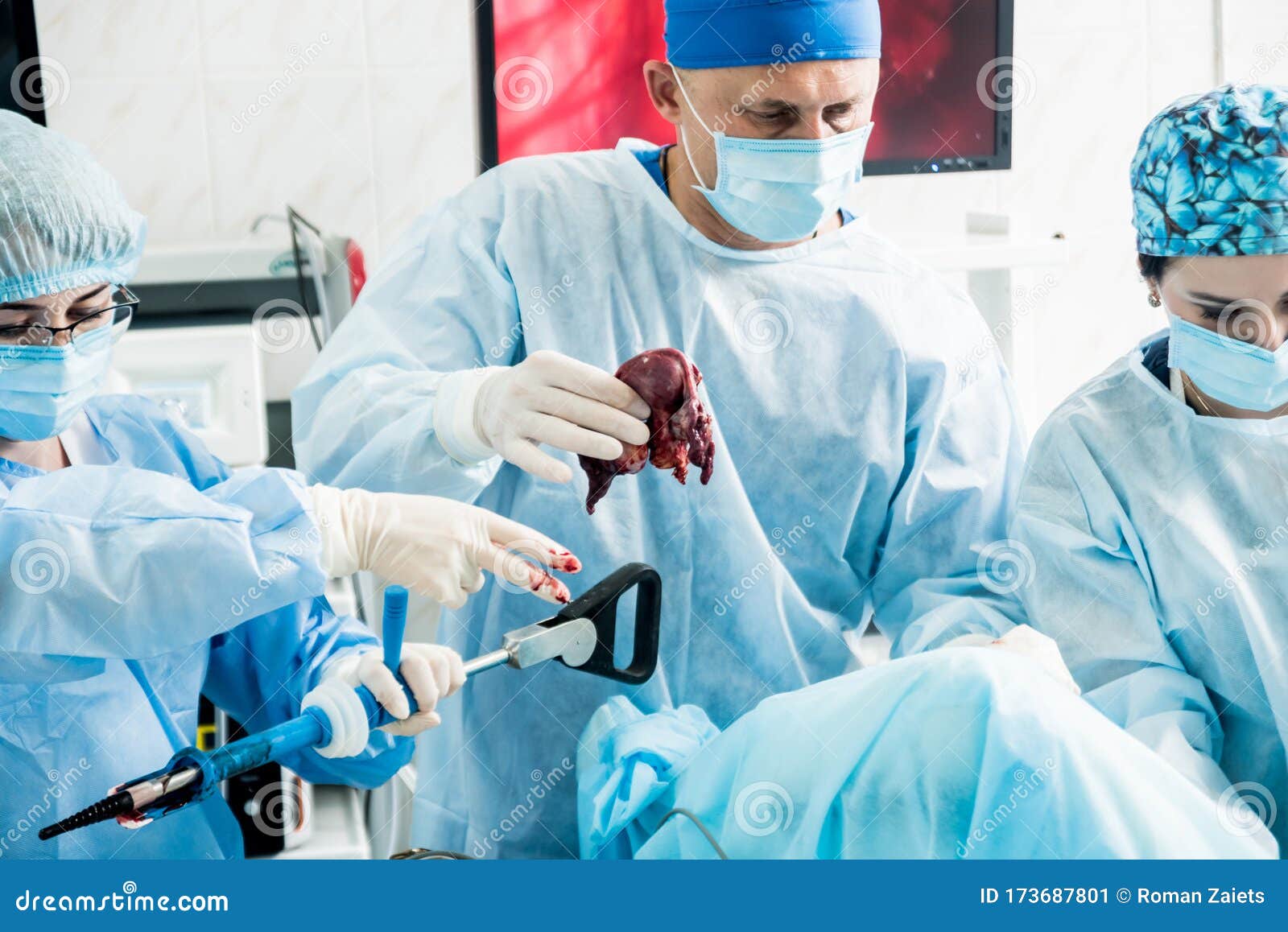 Process of Gynecological Surgery Operation Using Laparoscopic Equipment ...