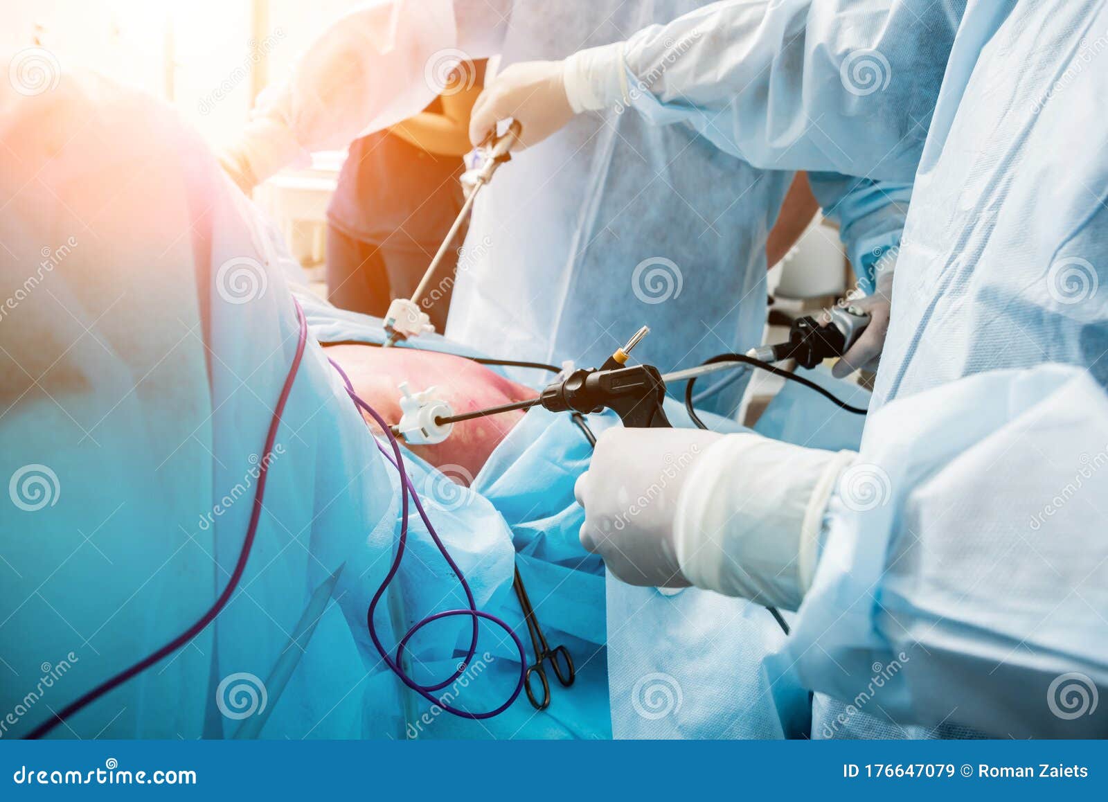 Process of Gynecological Surgery Operation Using Laparoscopic Equipment ...