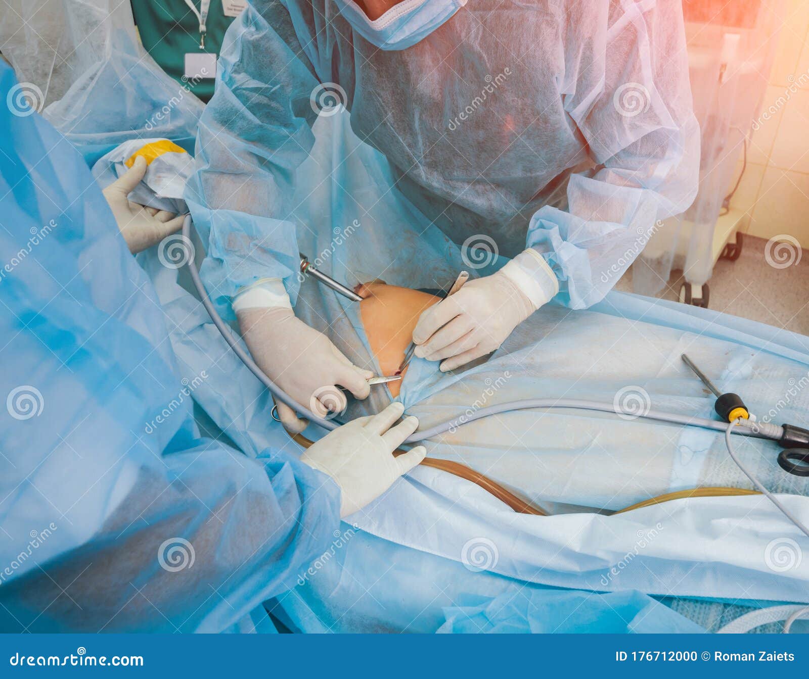 Process of Gynecological Surgery Operation Using Laparoscopic Equipment ...