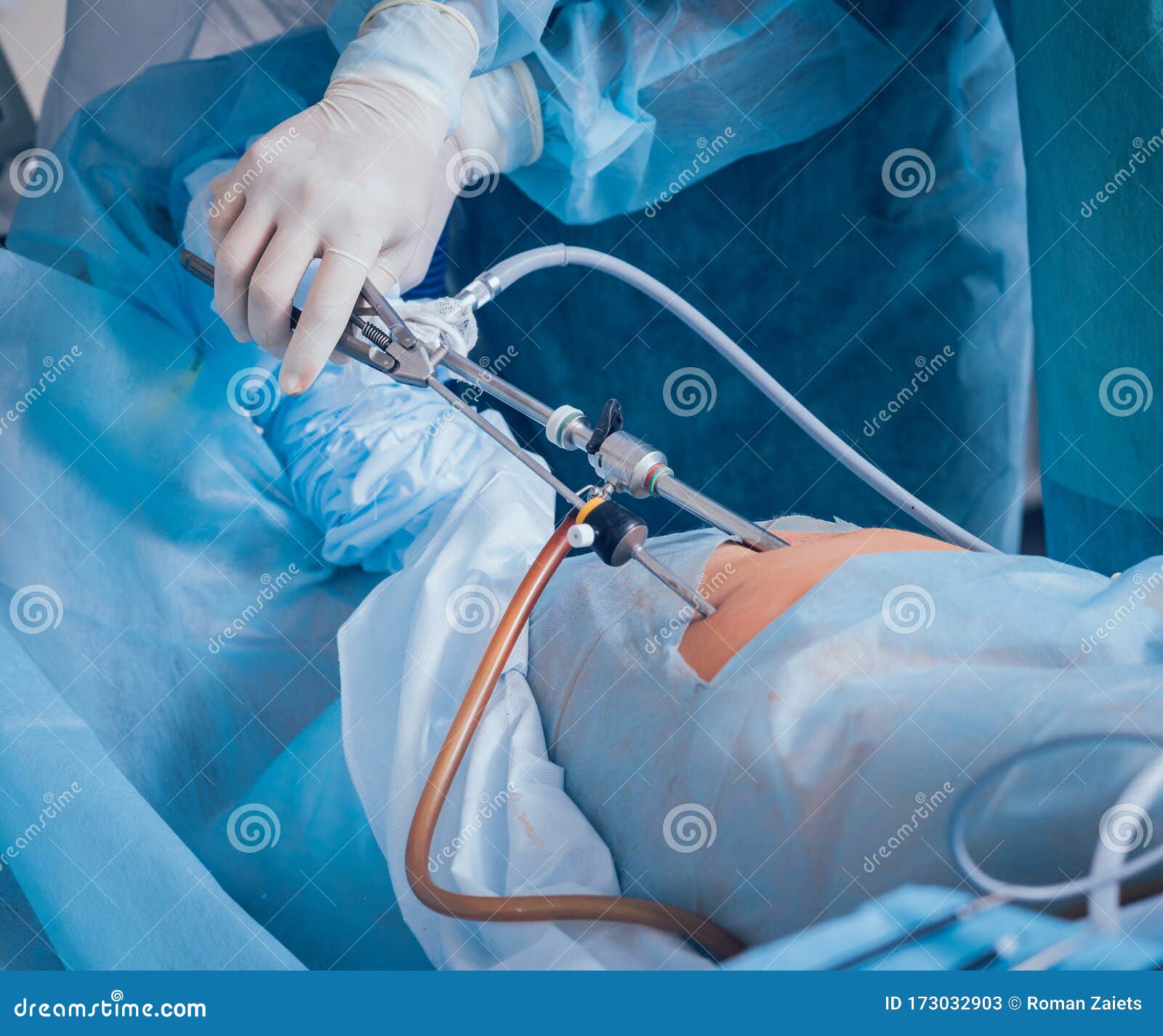 Process of Gynecological Surgery Operation Using Laparoscopic Equipment ...