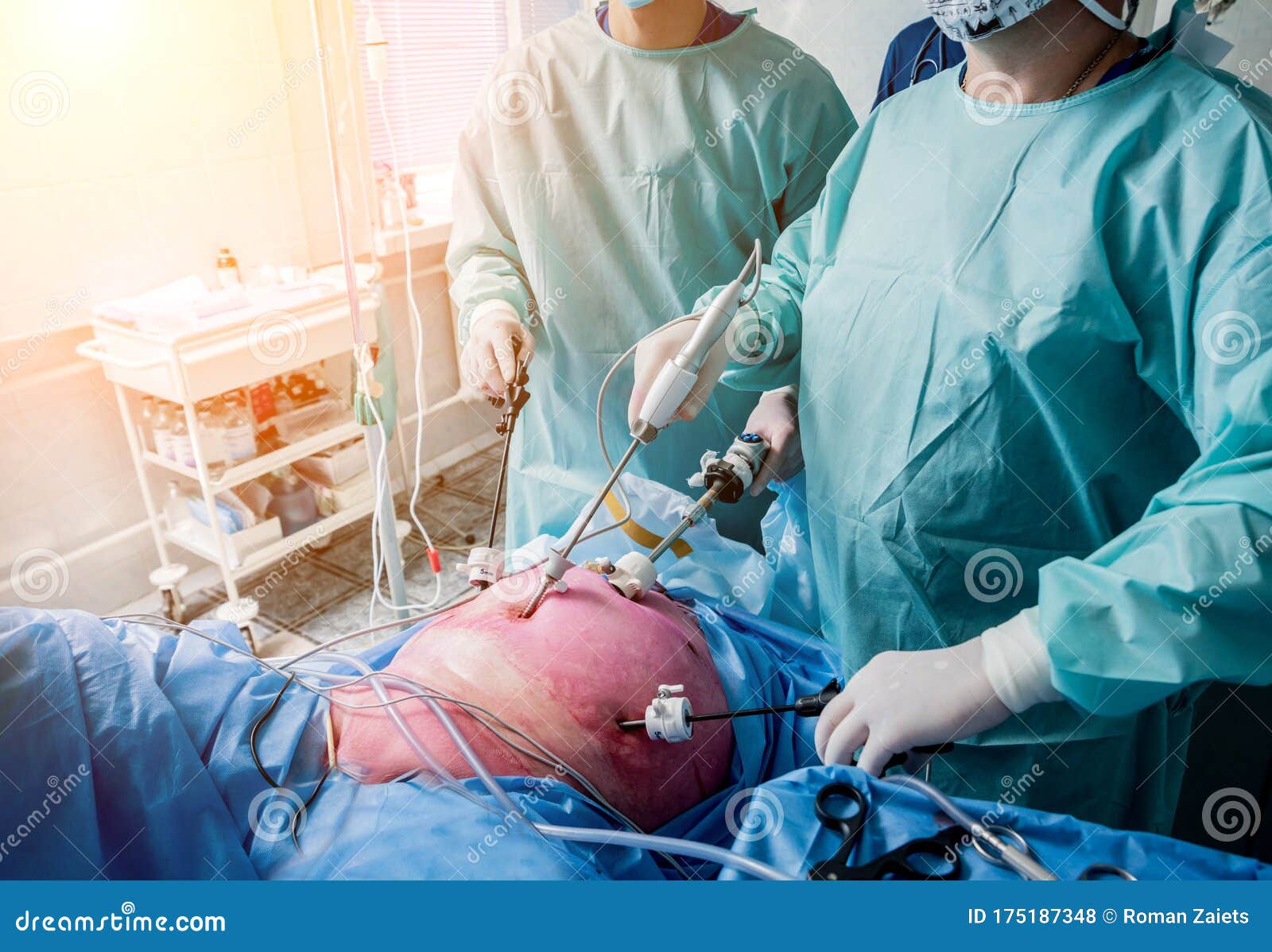 Process of Gynecological Surgery Operation Using Laparoscopic Equipment ...