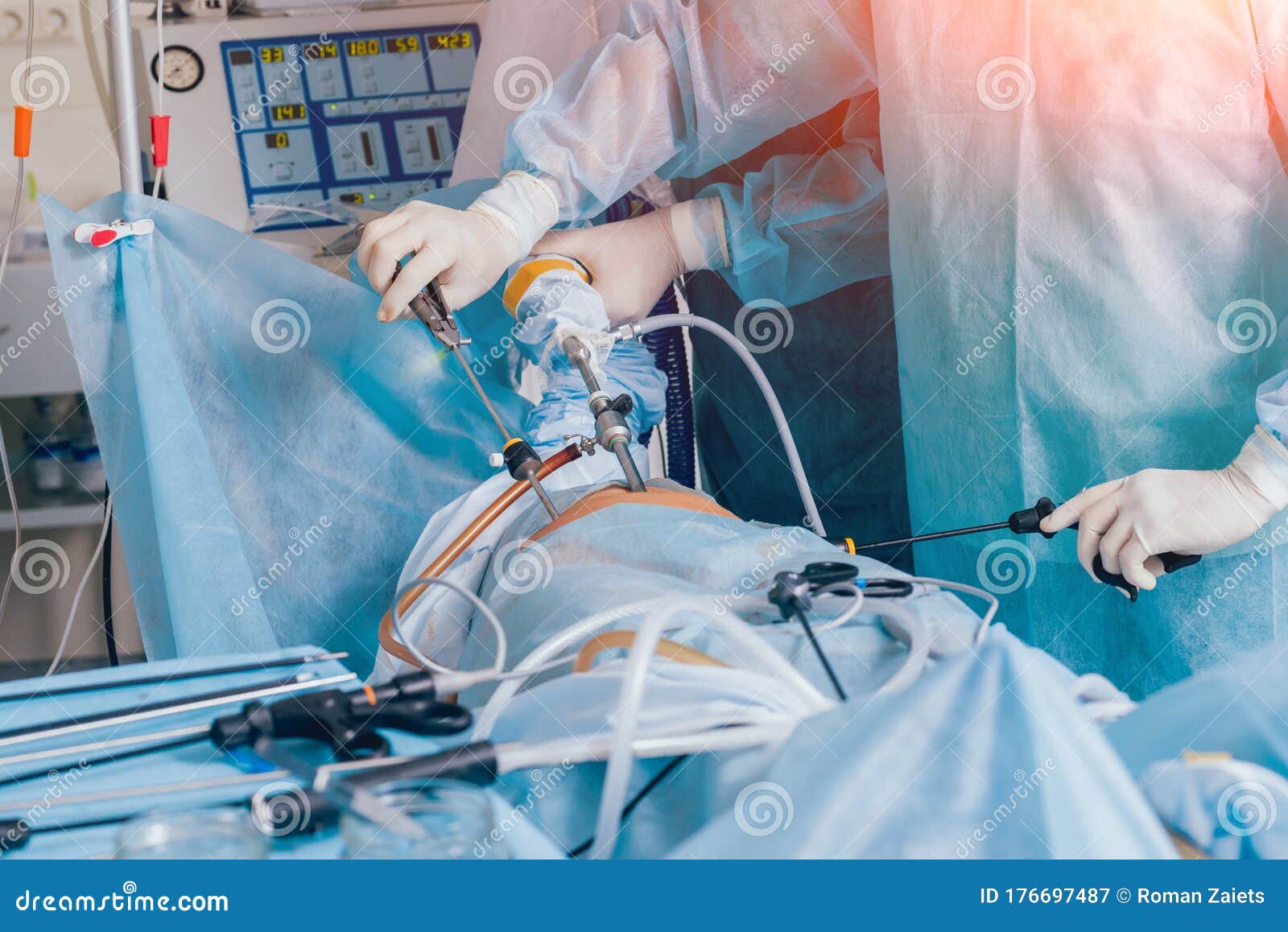 Process of Gynecological Surgery Operation Using Laparoscopic Equipment ...