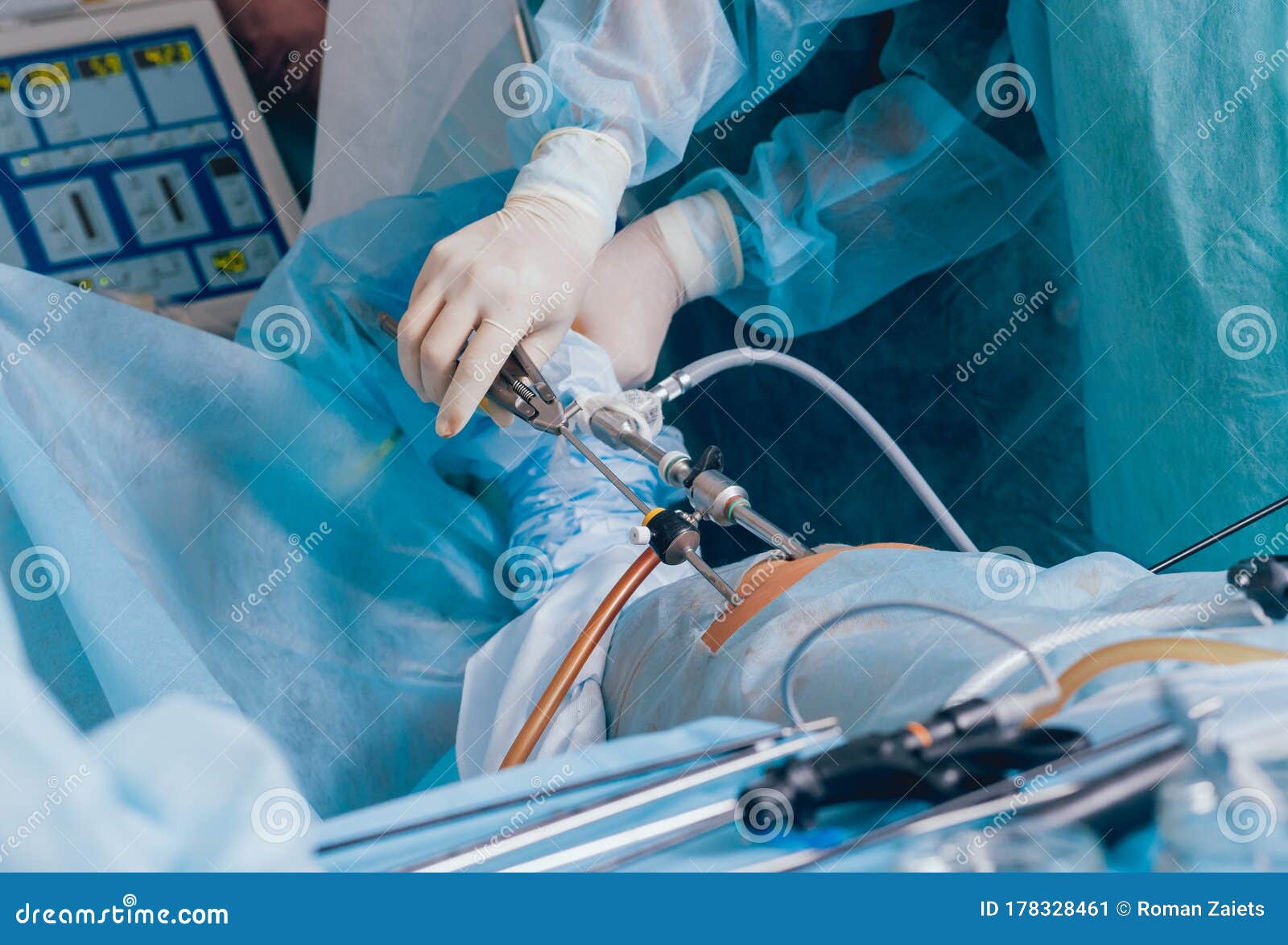 Process of Gynecological Surgery Operation Using Laparoscopic Equipment ...