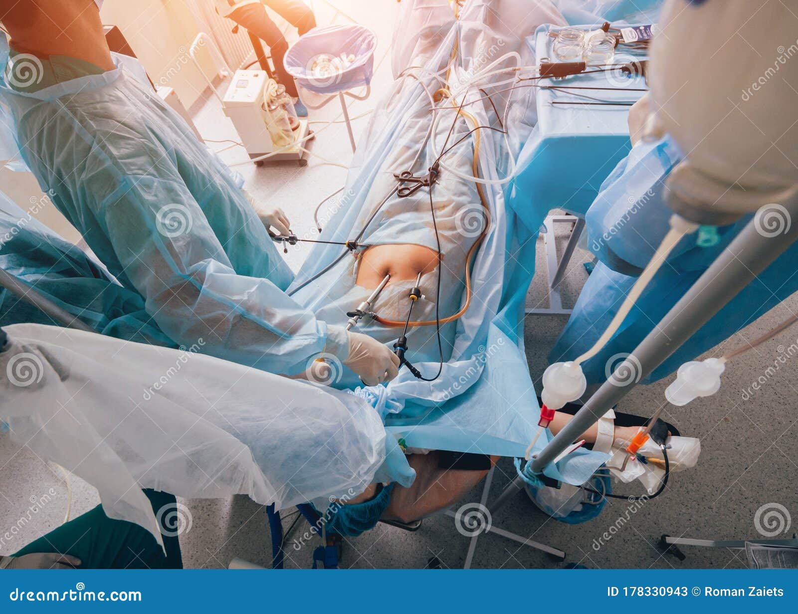 Process of Gynecological Surgery Operation Using Laparoscopic Equipment ...