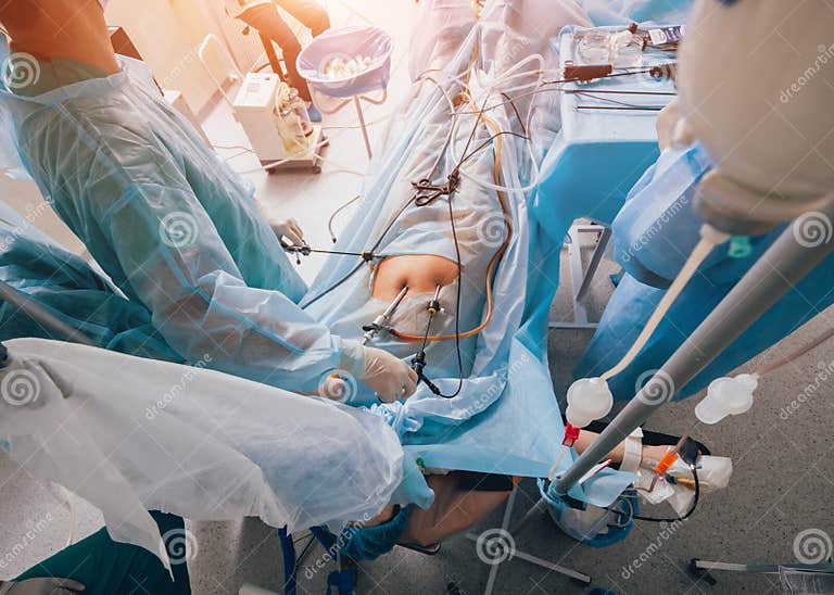 Process of Gynecological Surgery Operation Using Laparoscopic Equipment ...