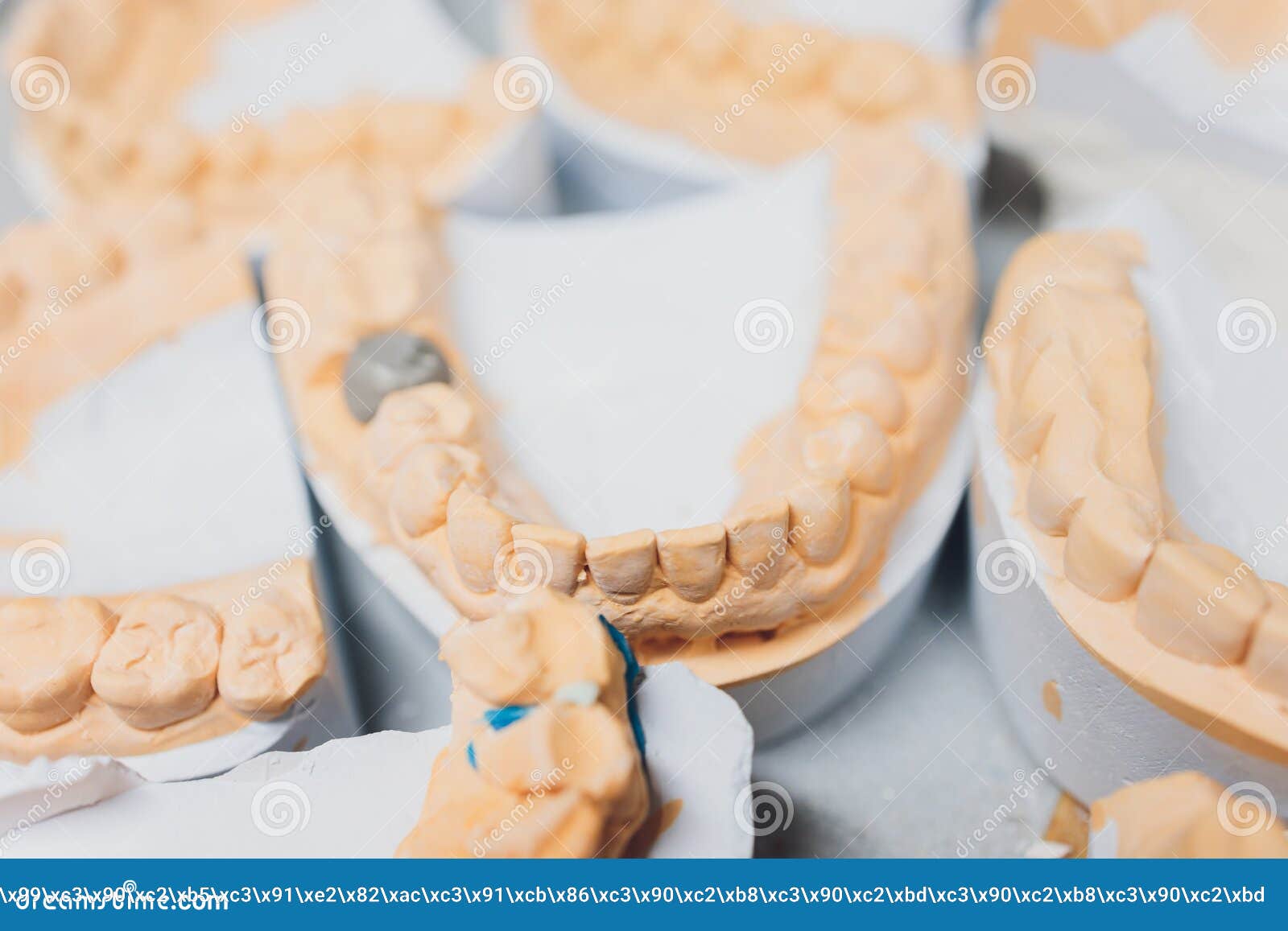 The Process of Making a Dental Prosthesis in a Dental Laboratory. Stock ...