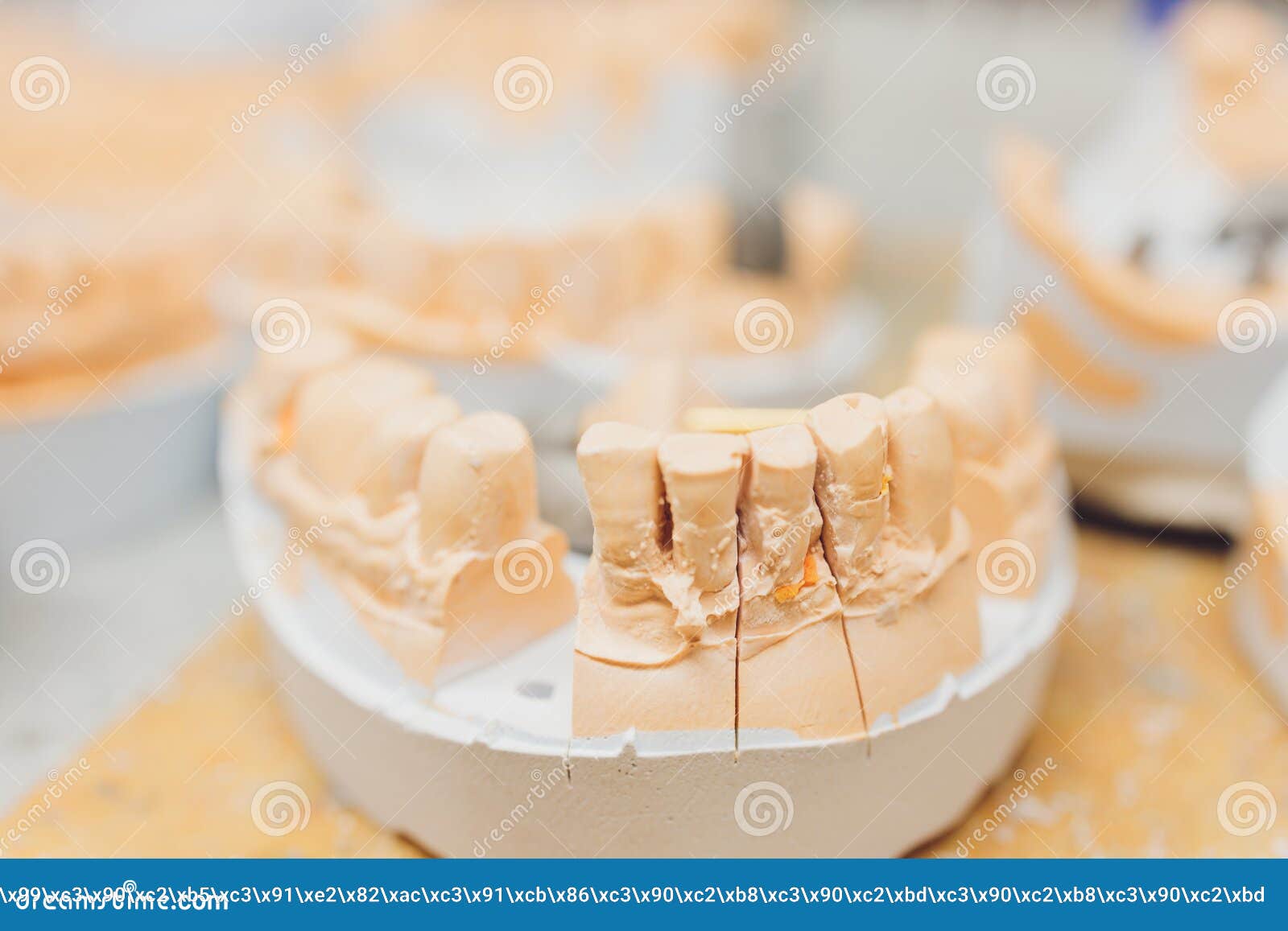 The Process of Making a Dental Prosthesis in a Dental Laboratory. Stock ...