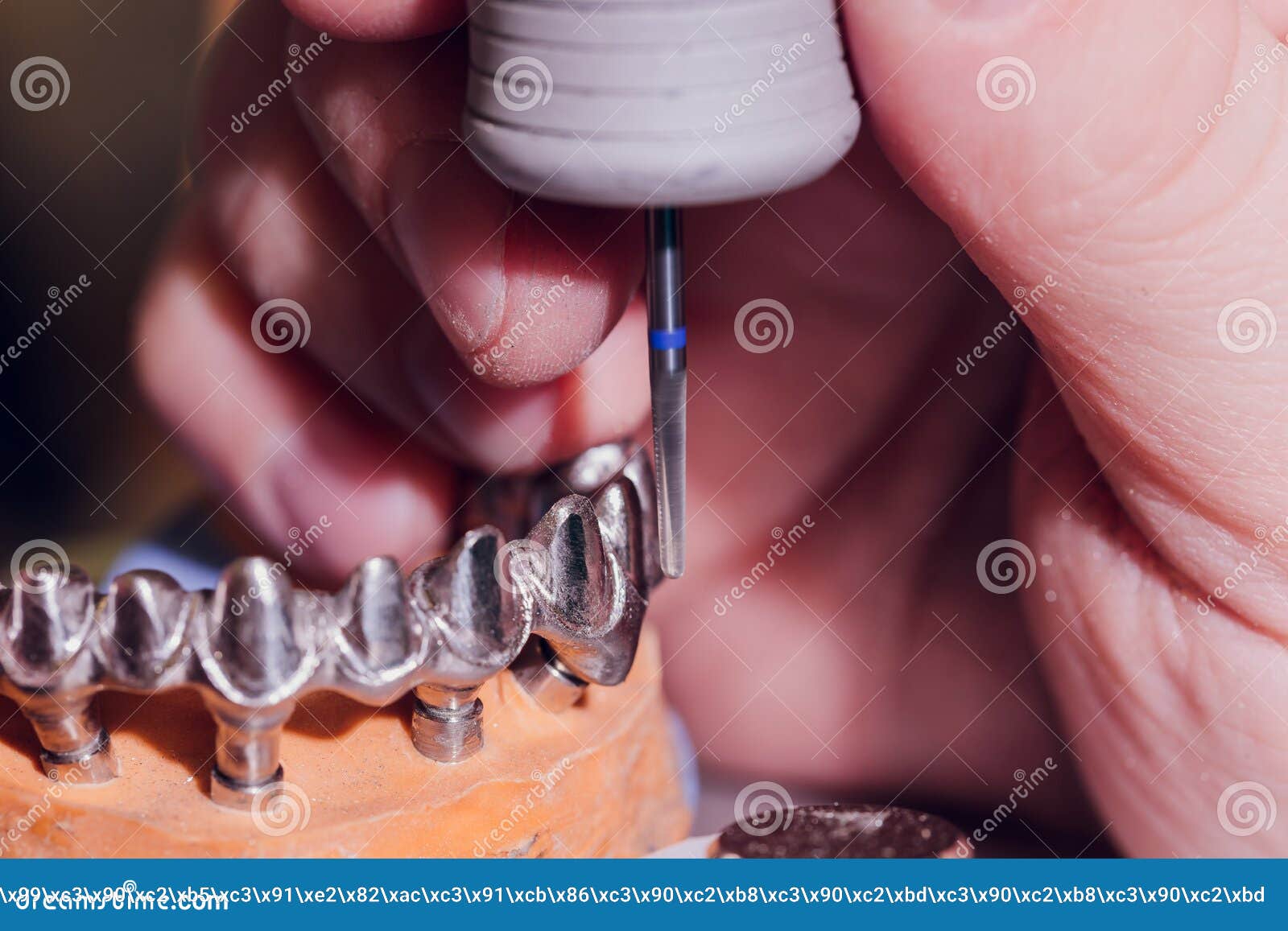 The Process of Making a Dental Prosthesis in a Dental Laboratory. Stock ...