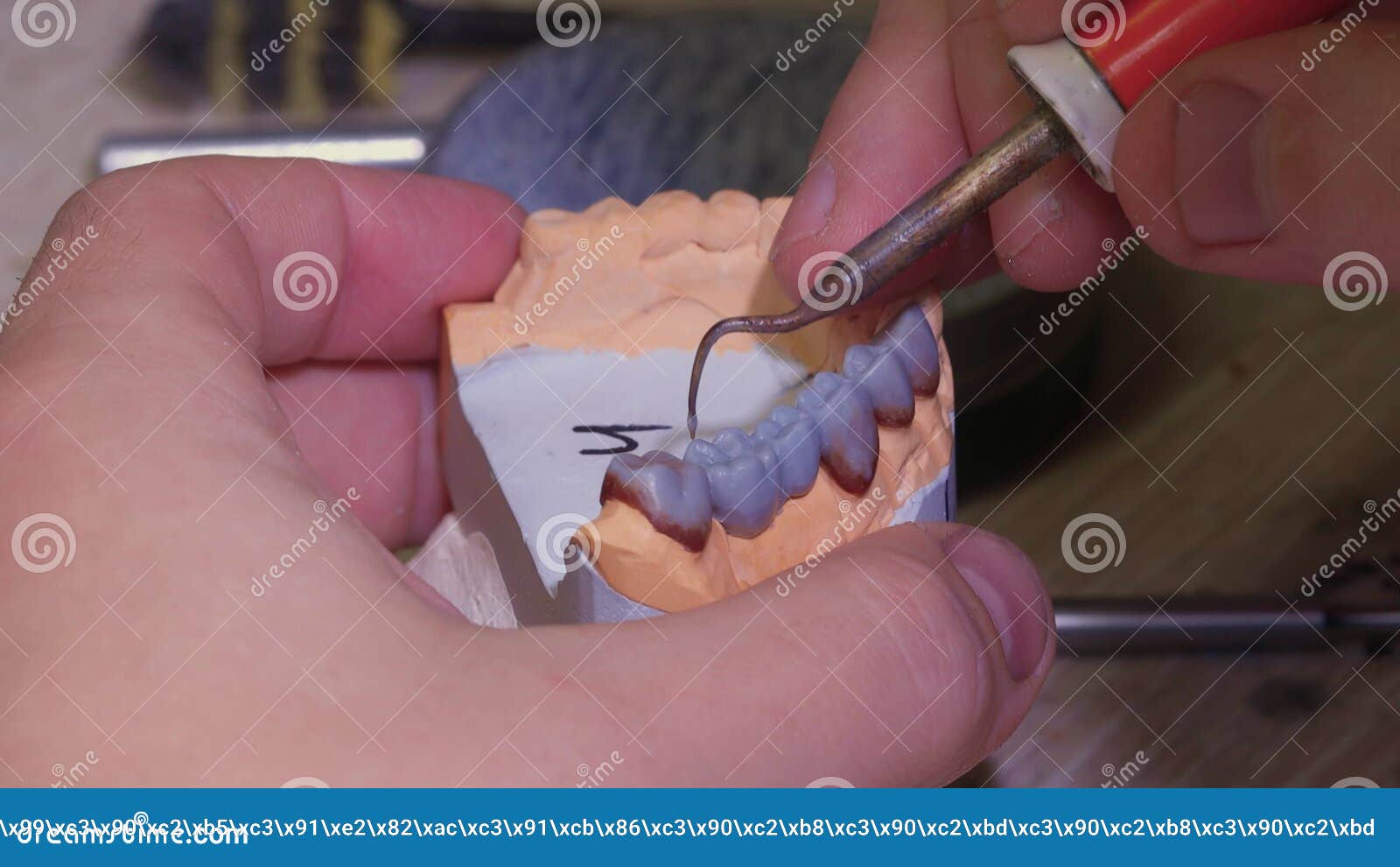 The Process of Making a Dental Prosthesis in a Dental Laboratory. Stock ...