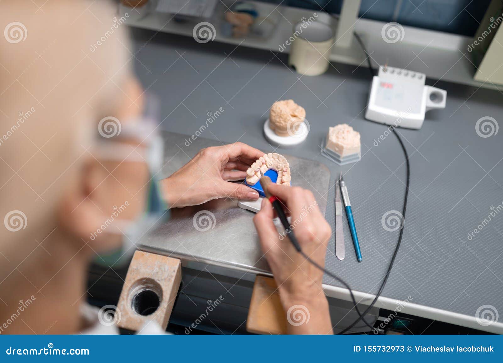 Process of Making Porcelain Veneers in Dental Clinic. Stock Image ...