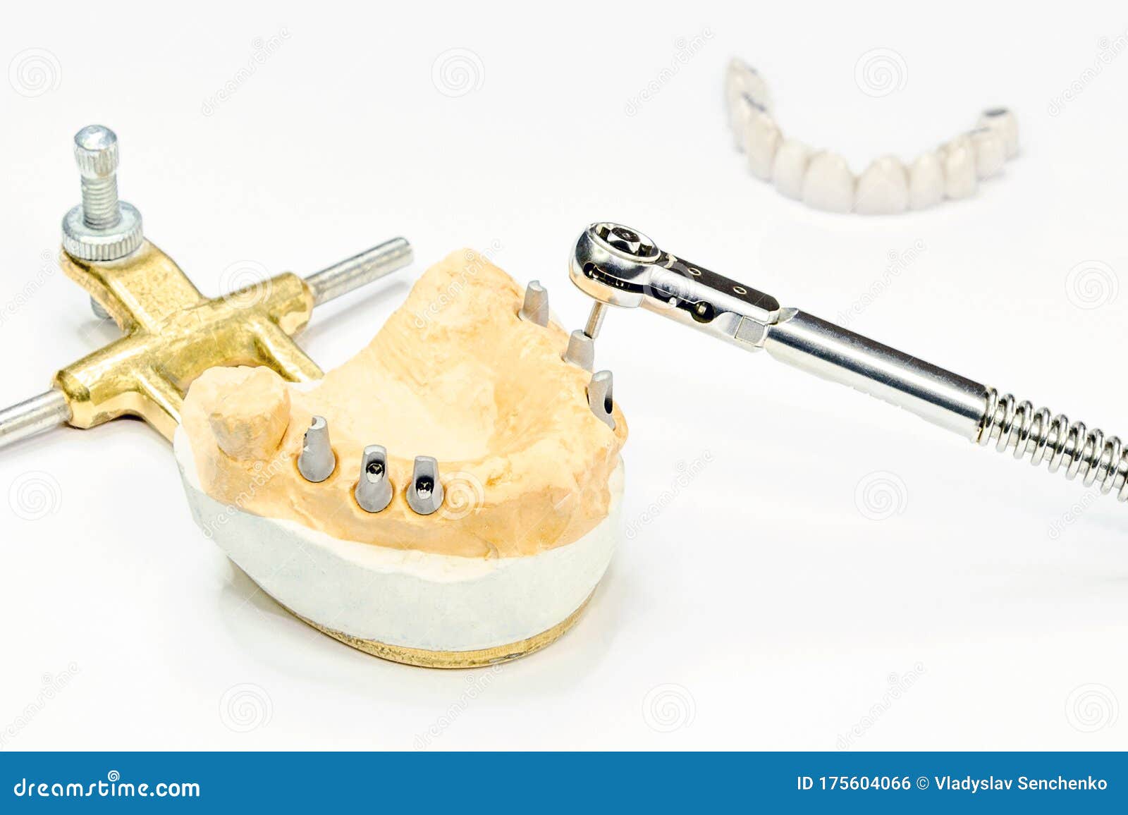 The Process of Manufacturing Ceramic Teeth on Implants. Dental Implants ...