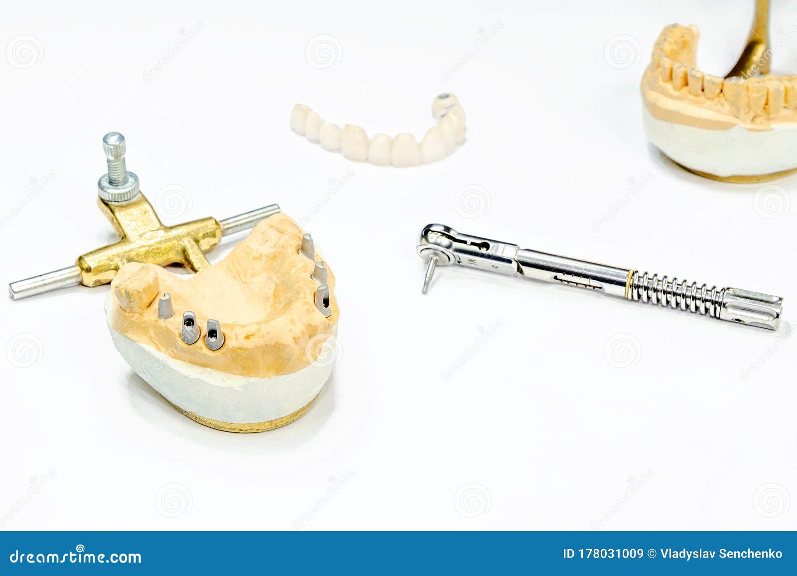 The Process of Manufacturing Ceramic Teeth on Implants. Dental Implants ...