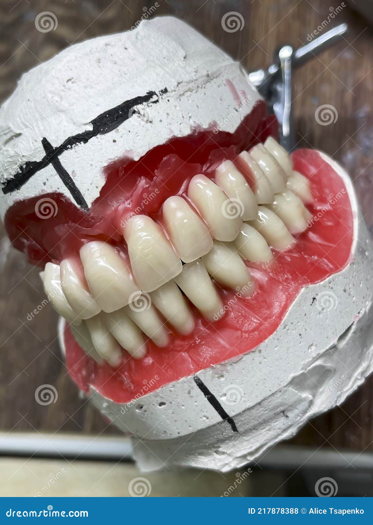 Removable Denture in the Laboratory on the Table Close-up. Stock Photo ...