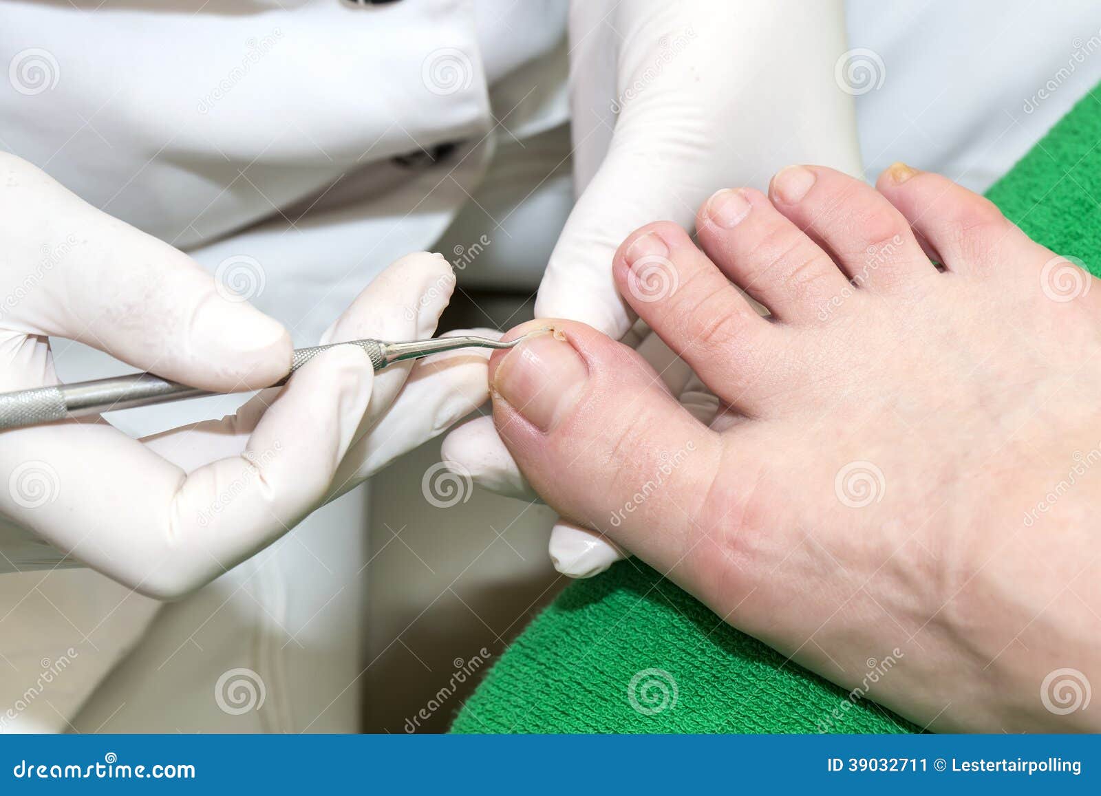 Process of pedicure stock image. Image of equipment, dermatology - 39032711