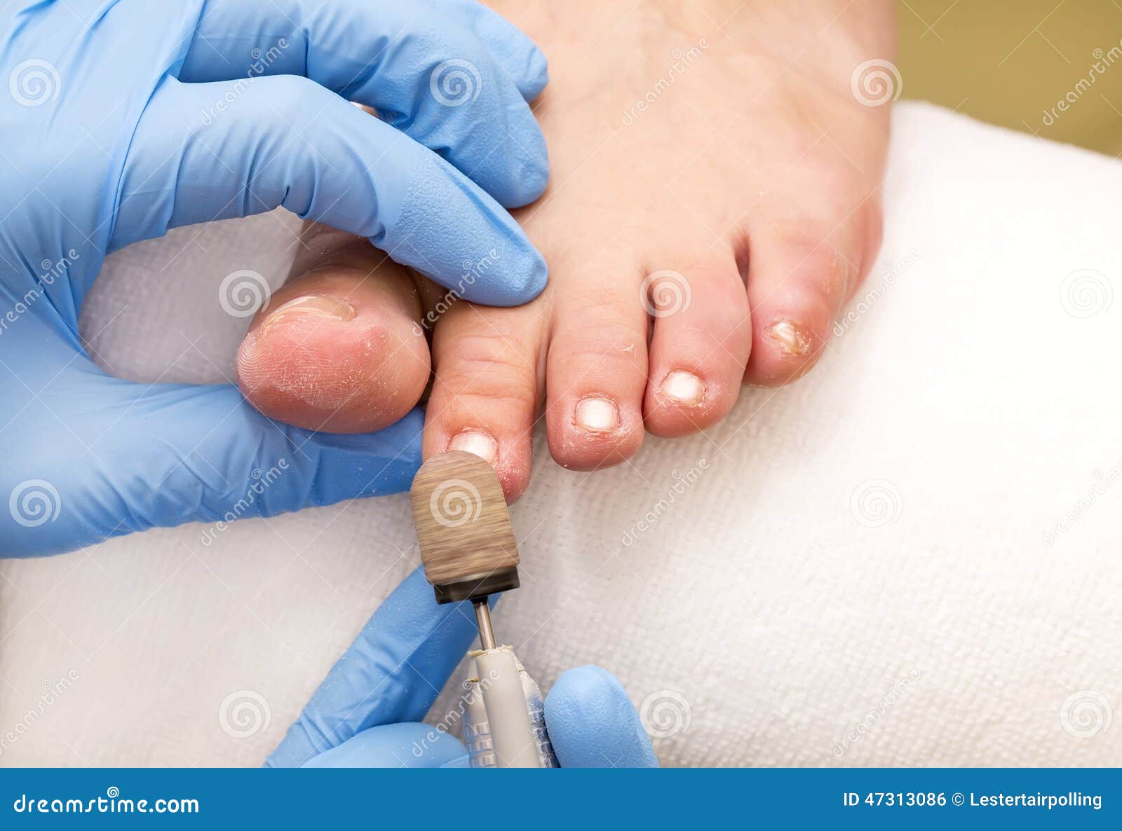 Process of pedicure stock photo. Image of chiropody, glove - 47313086