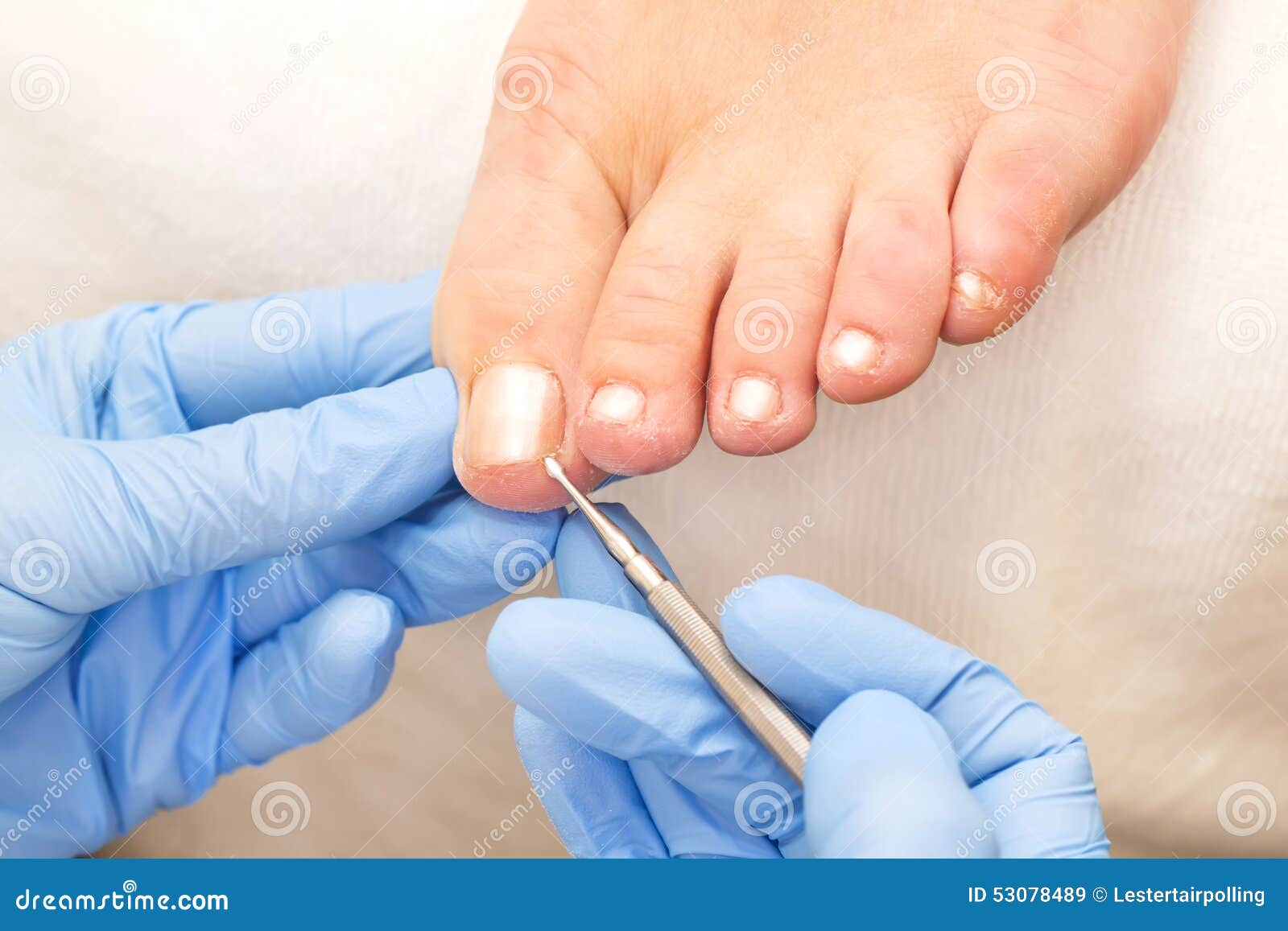 Process of pedicure stock image. Image of foot, macro - 53078489