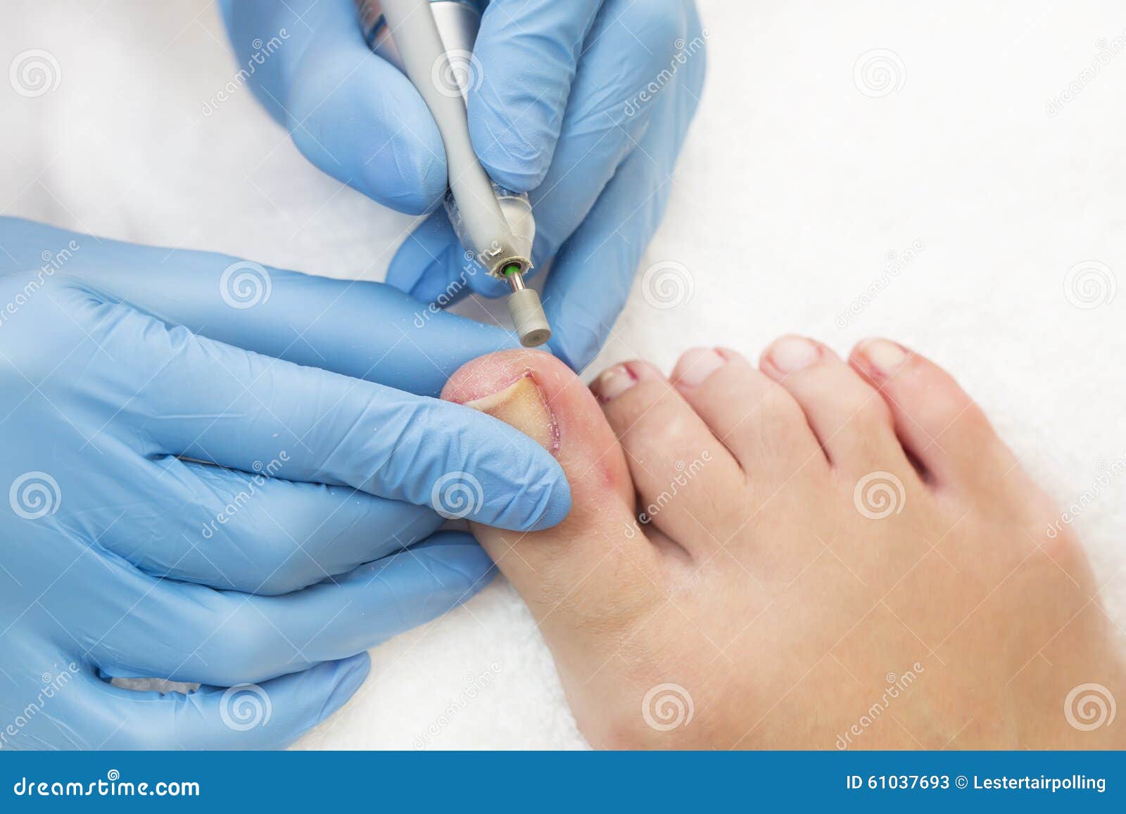Process of pedicure stock image. Image of chiropody, dermatology - 61037693