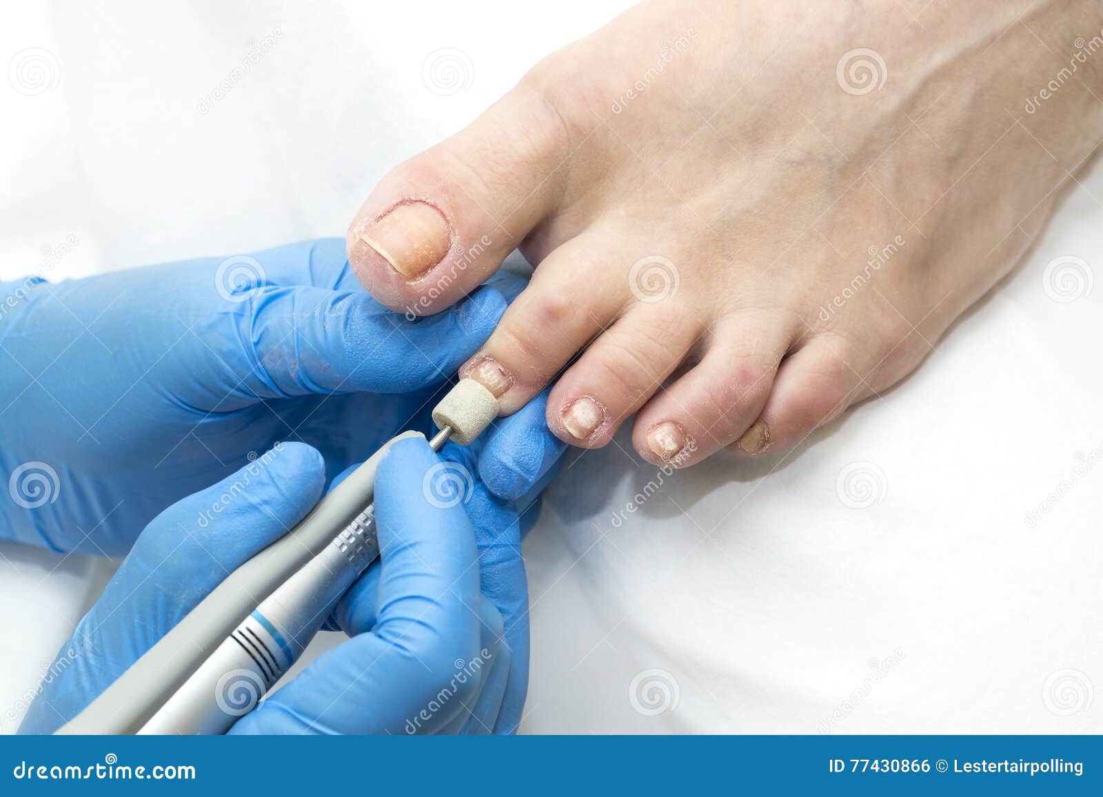 Process of pedicure stock photo. Image of medical, pedicurist - 77430866