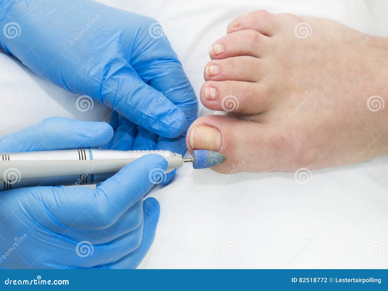 Process of pedicure stock photo. Image of peeling, hand - 82518772