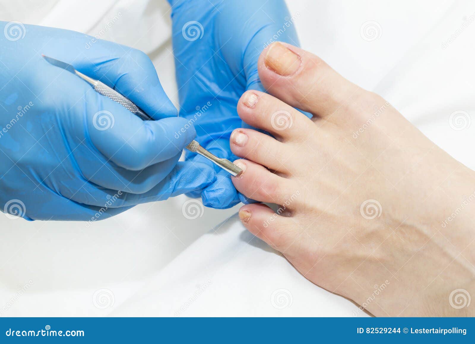 Process of pedicure stock photo. Image of caucasian, finger - 82529244