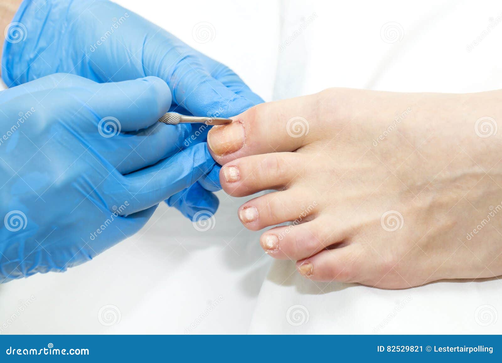 Process of pedicure stock image. Image of foot, glove - 82529821