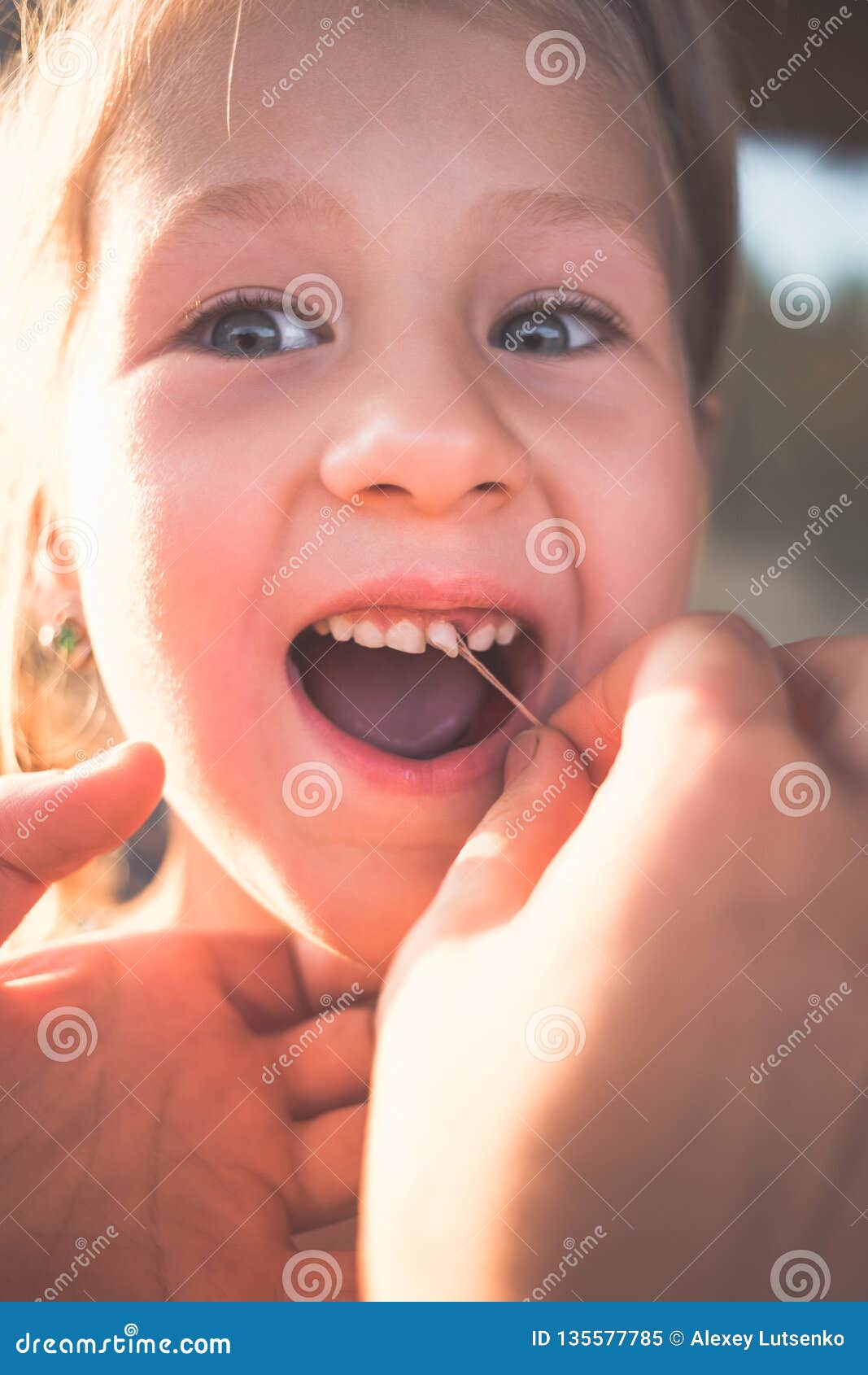 The Process of Removing a Baby Tooth Using a Thread Stock Image - Image ...